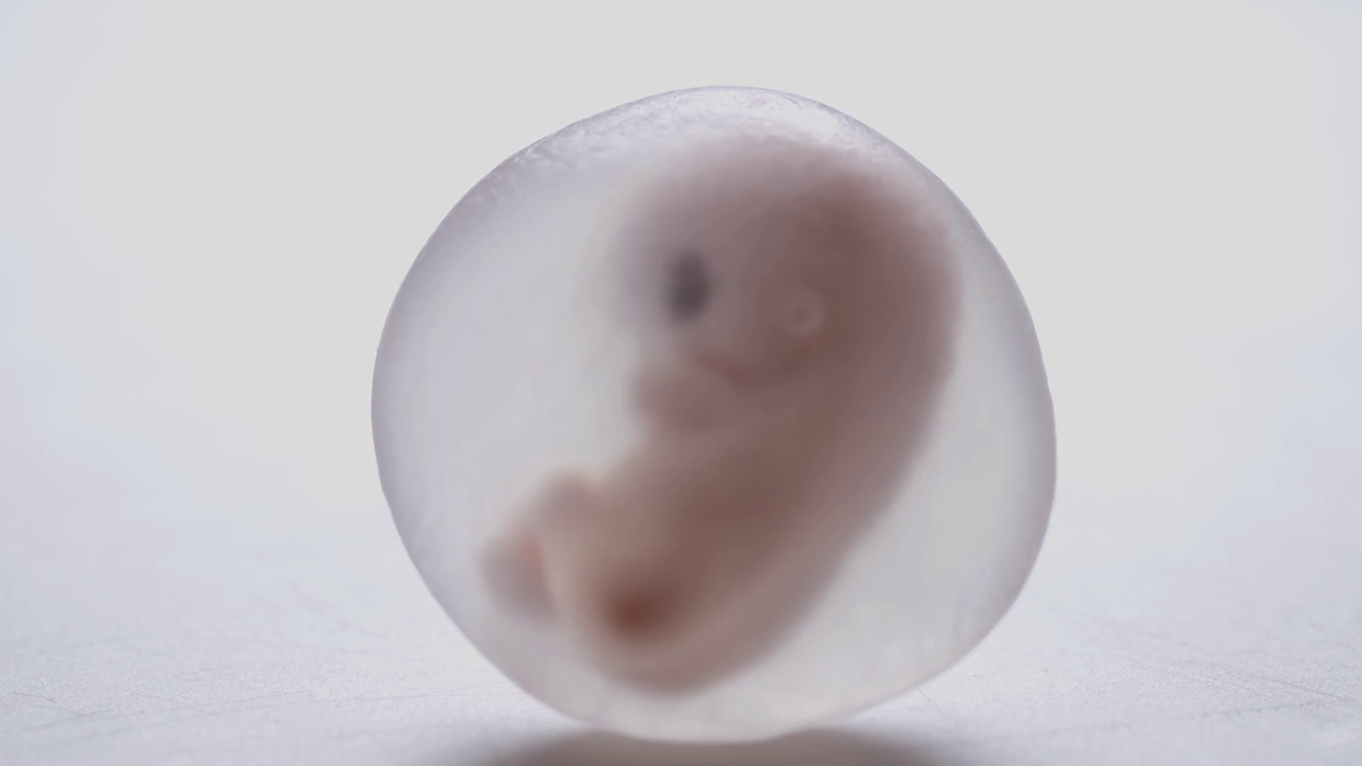 Defocus From Human Embryo Fetus On White Stock Footage SBV-347543904 ...