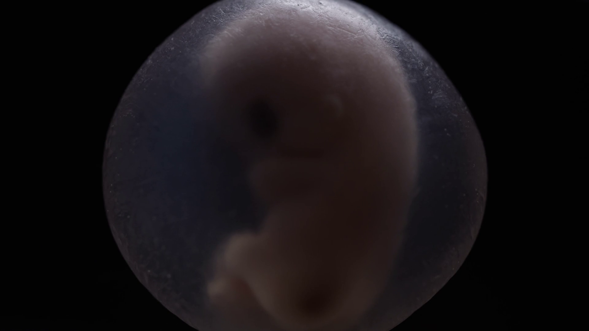 Rack Focus To Fetal Embryo On Black Stock Footage SBV-347543893 ...