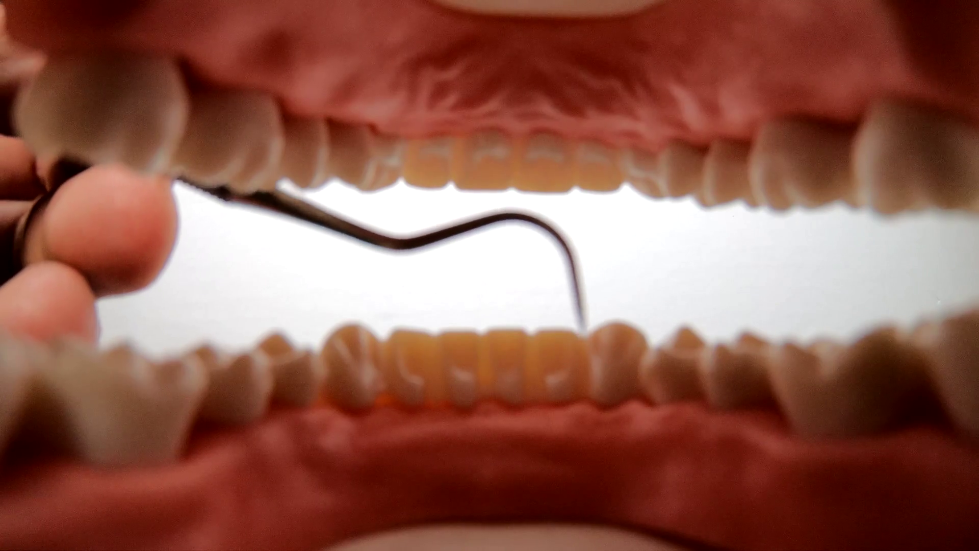 Unique Angle Inside Mouth Dentist Picking Stock Footage SBV-347717858 ...