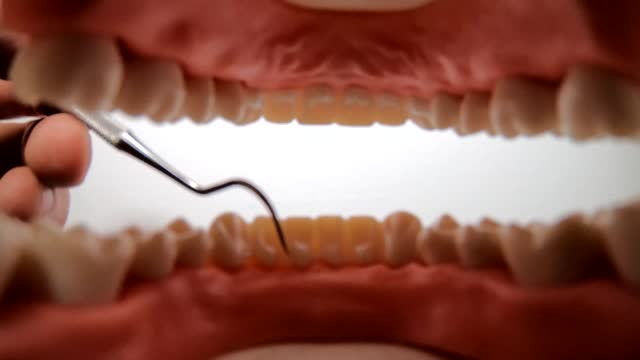 Teeth Cavities Stock Footage: Royalty-Free Video Clips - Storyblocks