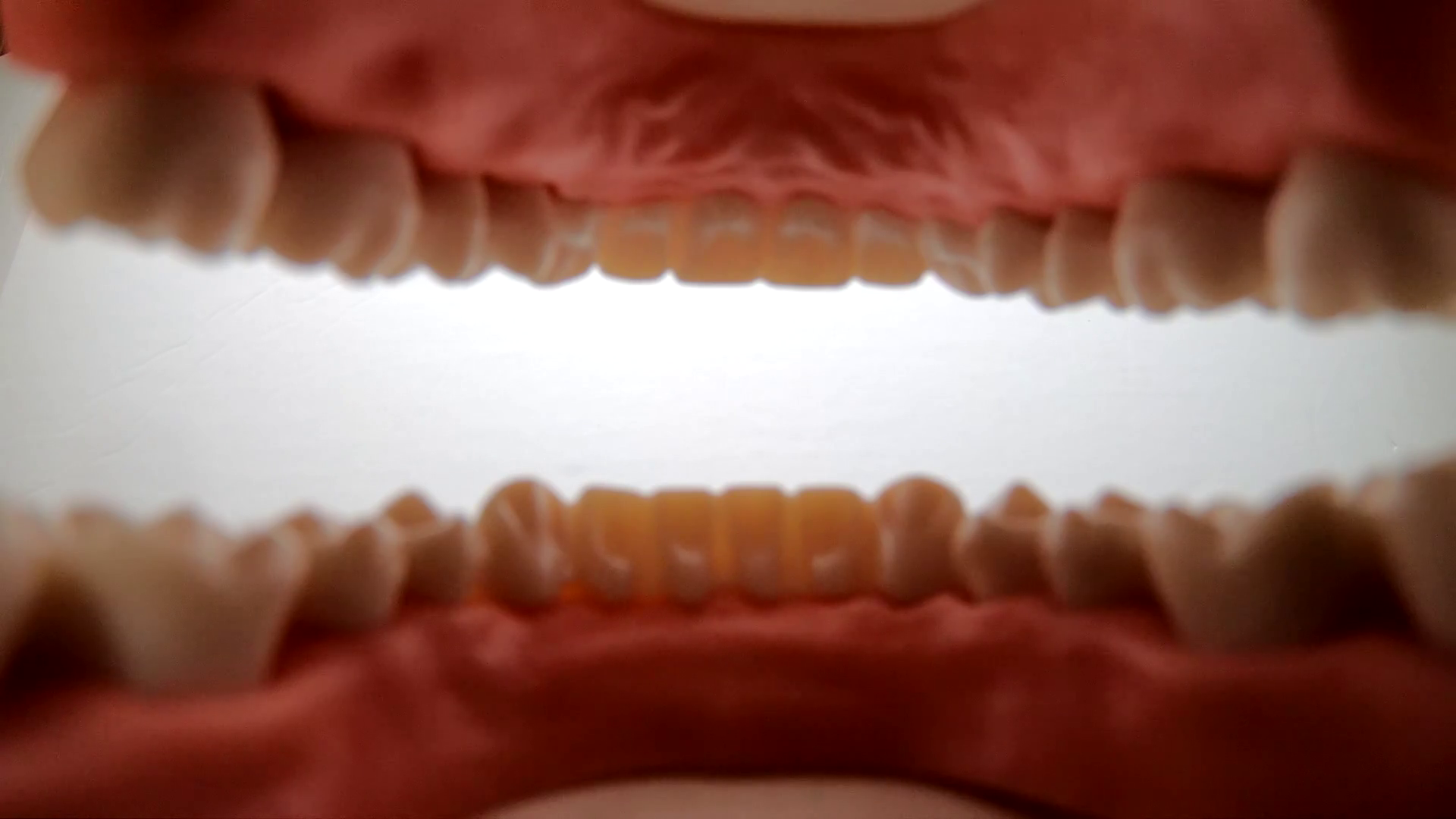 Unique Angle Inside Mouth Dentist Using Stock Footage SBV-347717864 ...