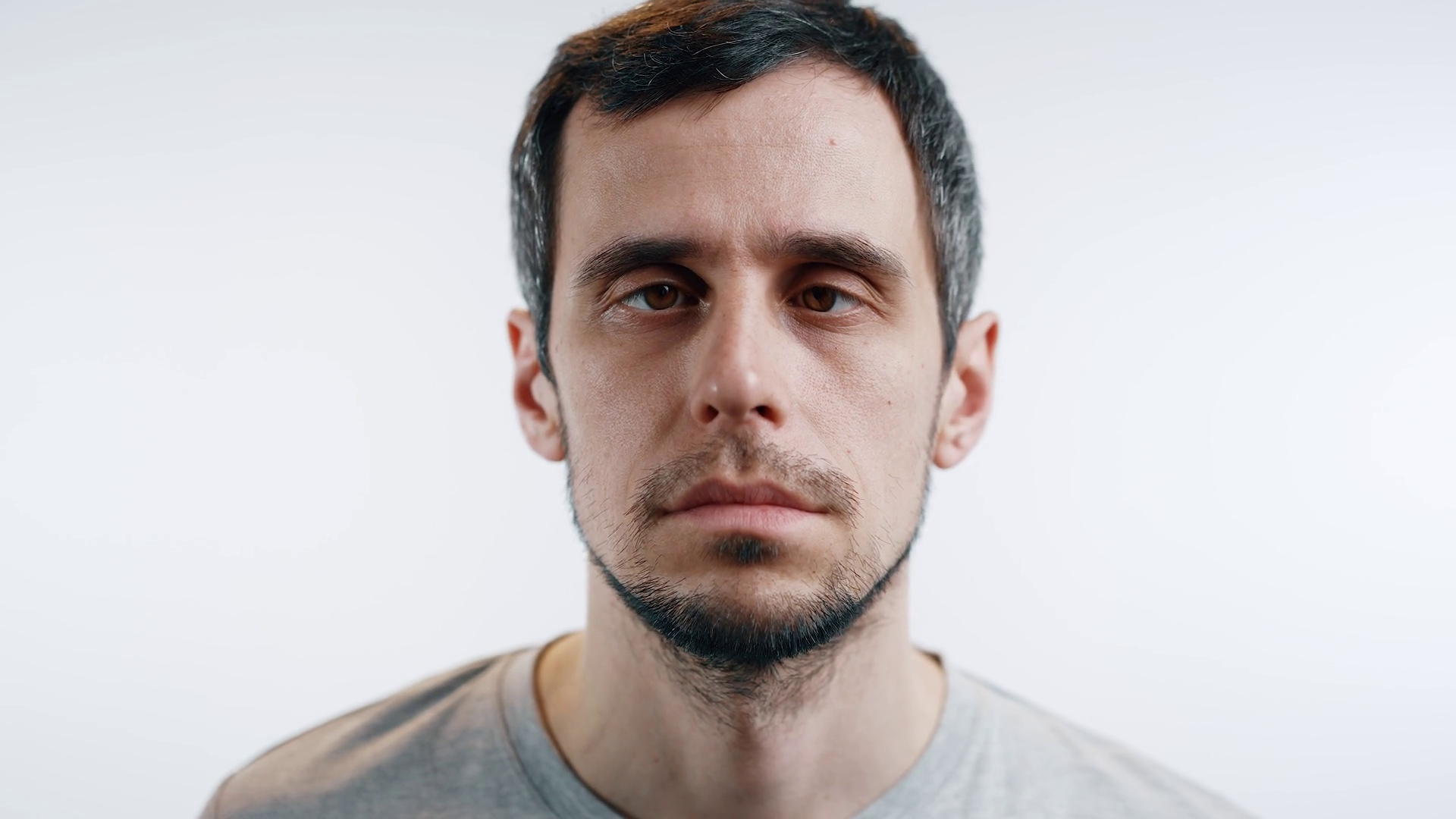 Portrait Of Man With Strabismus Stock Footage SBV-351989739 - Storyblocks