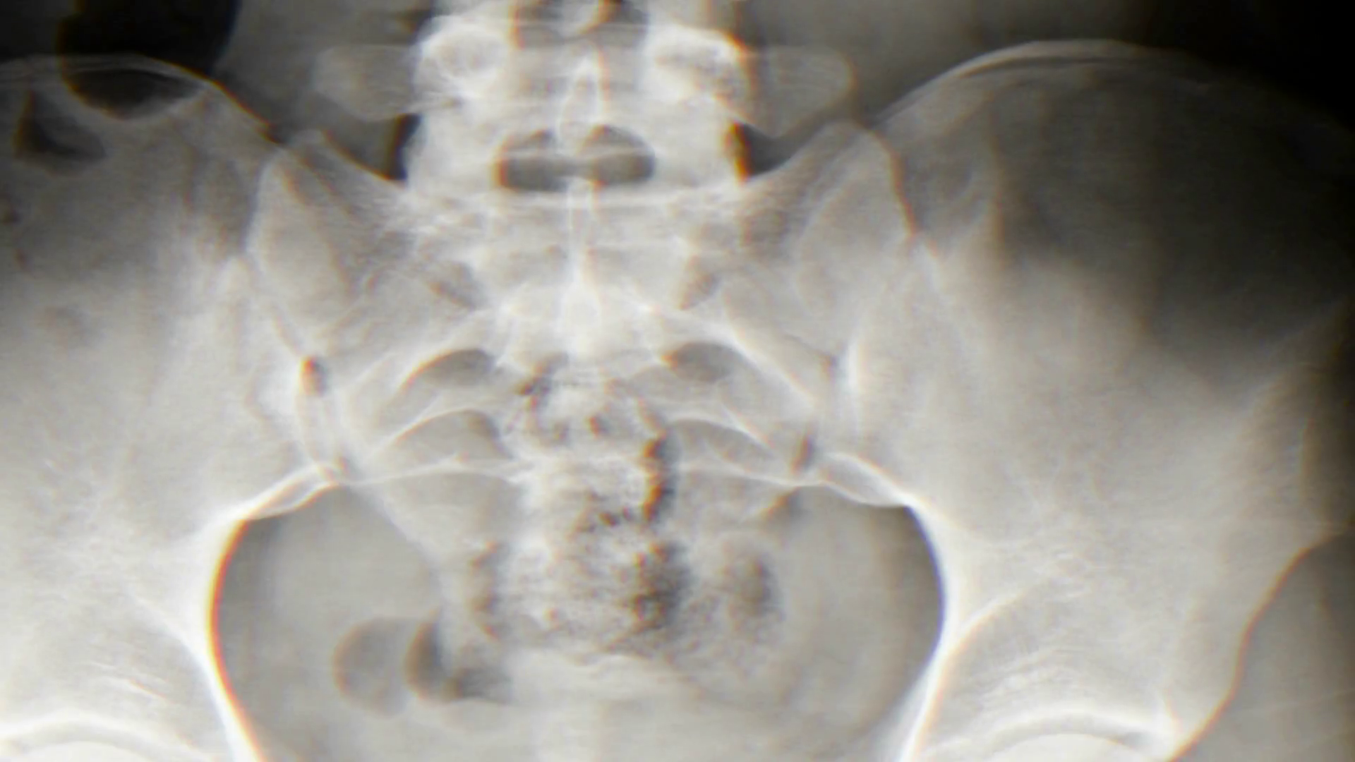 Background Of X-ray Stock Footage SBV-306447659 - Storyblocks