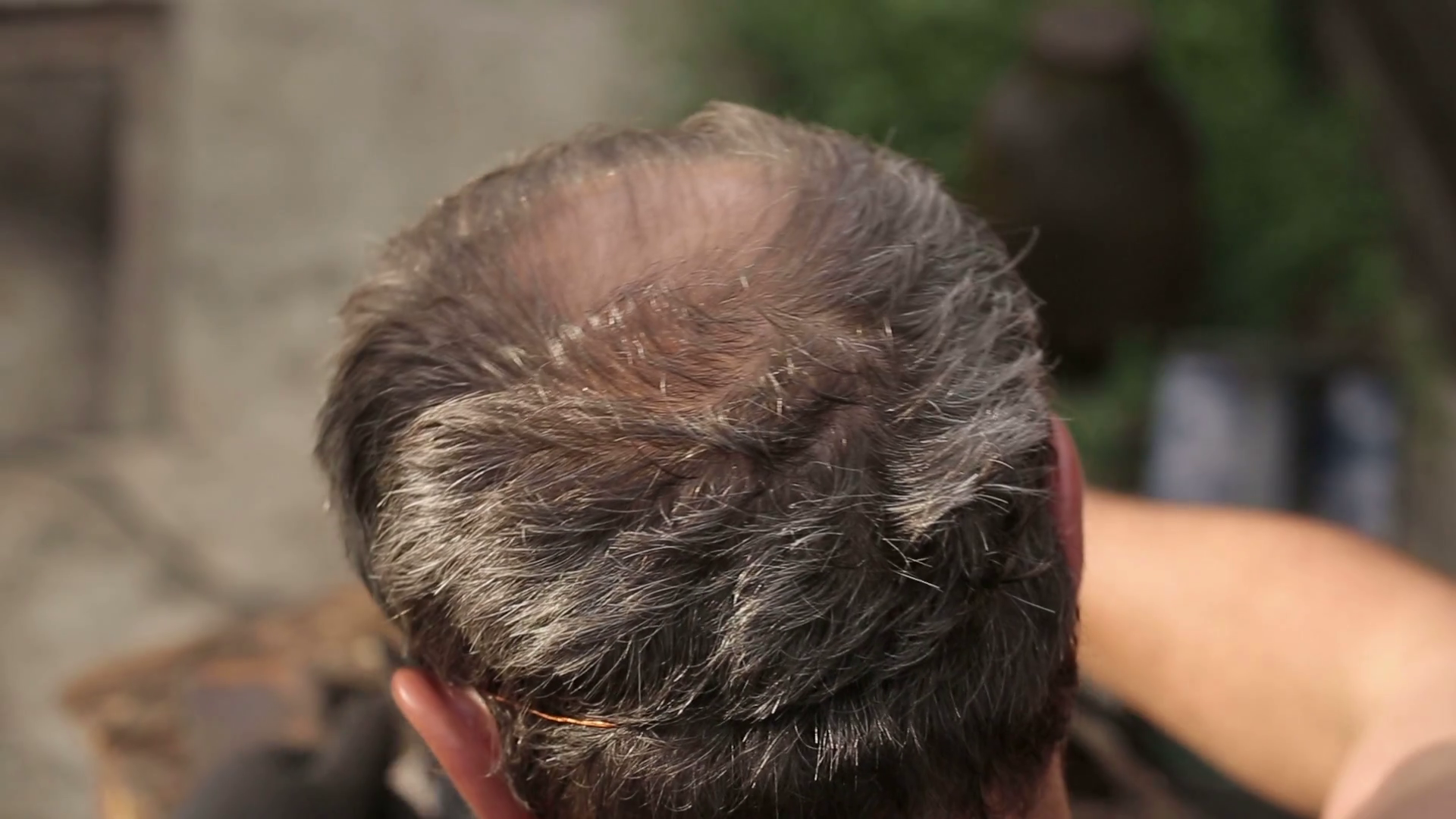 Balding Man's Head Stock Footage SBV-307083325 - Storyblocks
