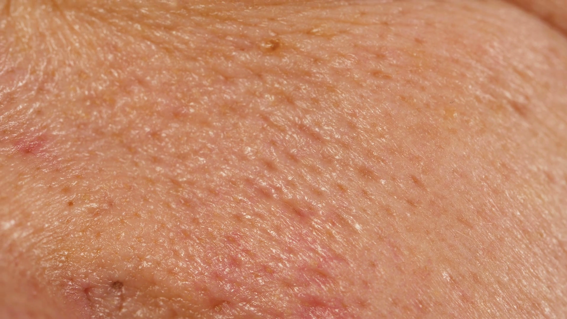 Problem Skin Of Man Stock Footage SBV-316239879 - Storyblocks