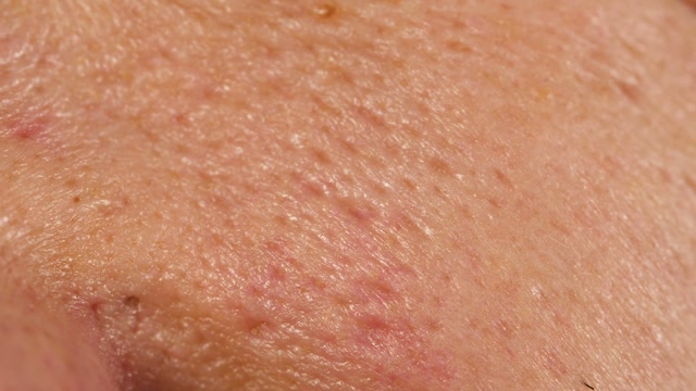 Goosebumps Skin Stock Footage: Royalty-Free Video Clips - Storyblocks