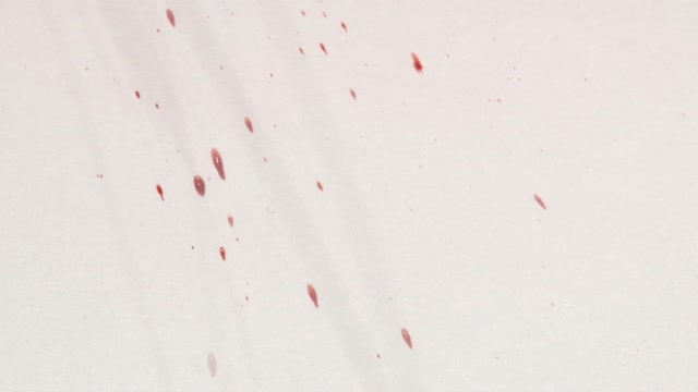 Blood Splatter On Camera Lens Stock Footage: Royalty-Free Video Clips ...