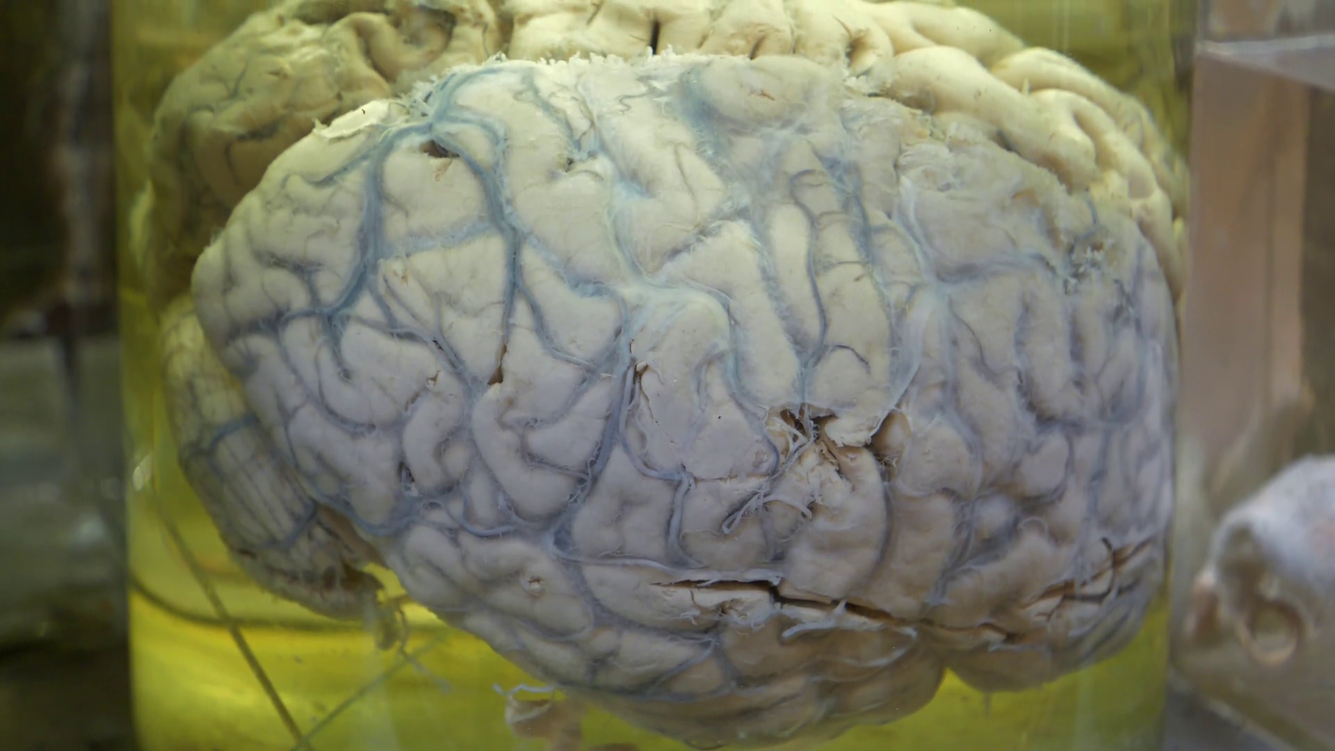 Real Human Brain Grey Matter Human Brain In Stock Footage SBV-349104826 ...