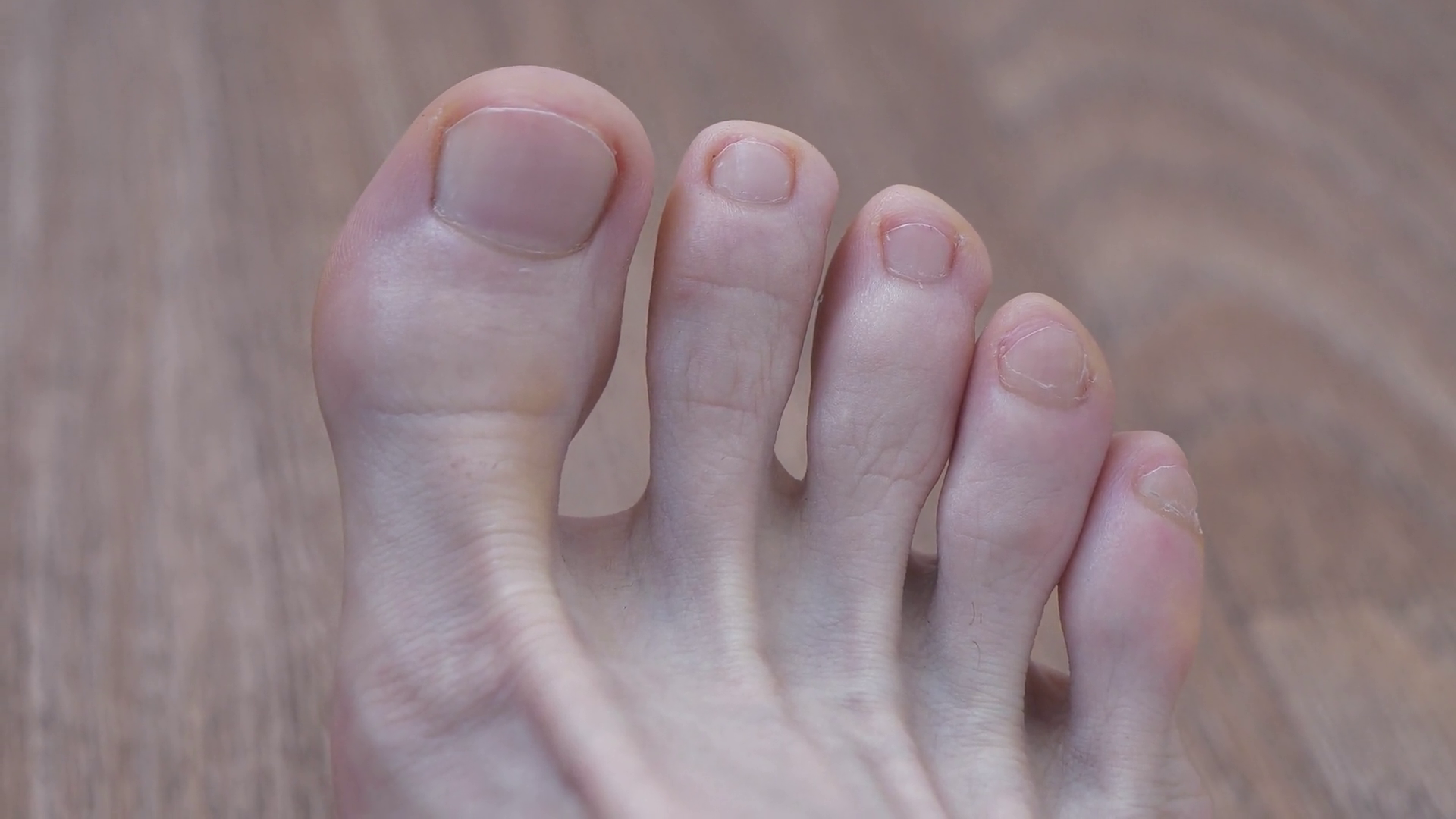 Close Up View Of Foot Toes Of Adult Male Man Stock Footage SBV ...