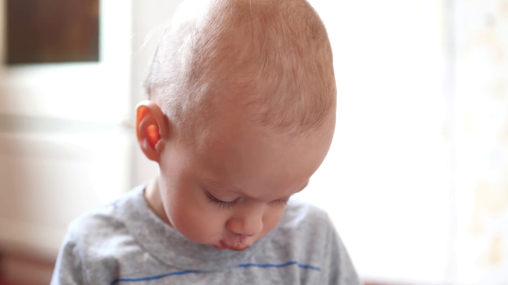 Baby Boy With Scratch Of Lips Nose Chin Stock Footage SBV-337157000 ...
