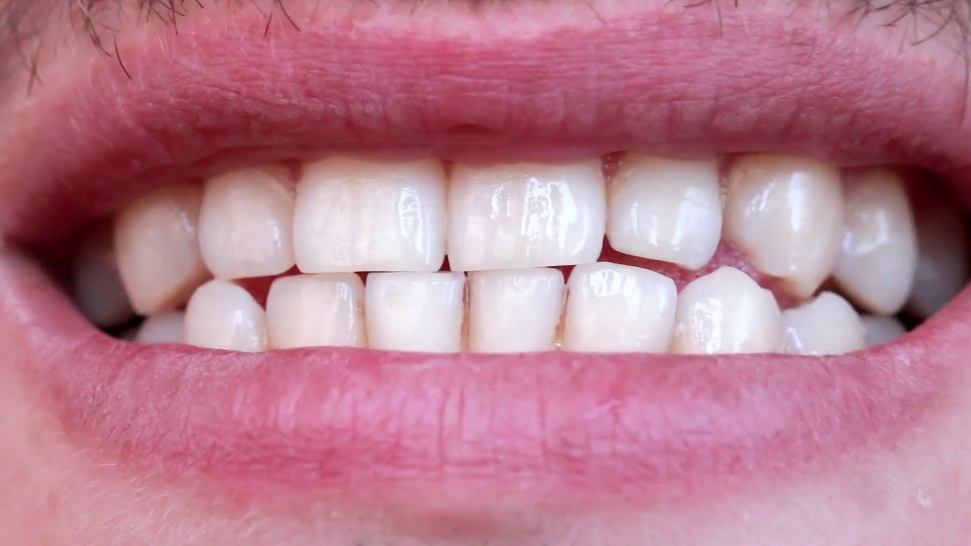 White Teeth Video Stock Footage Stock Footage SBV-304839216 - Storyblocks