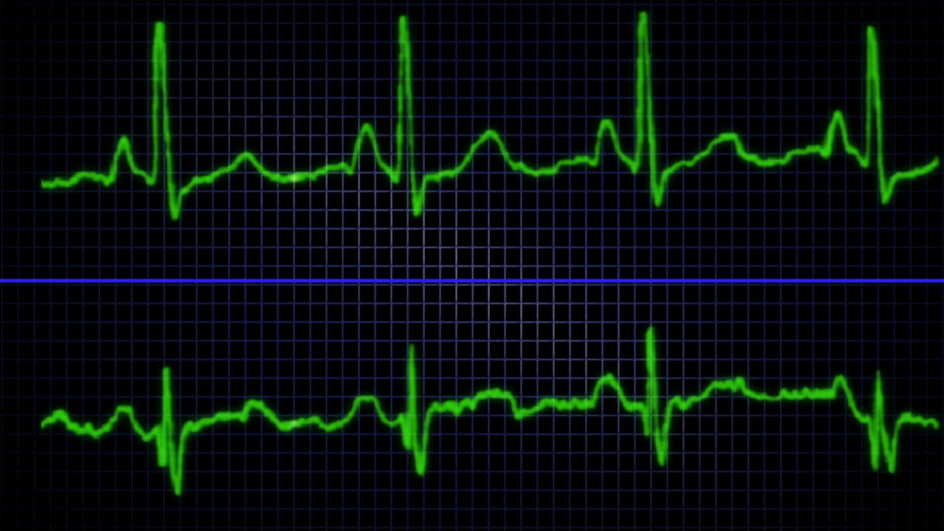 Looping Heart Ekg Graphic Stock Motion Graphics SBV-300338919 - Storyblocks