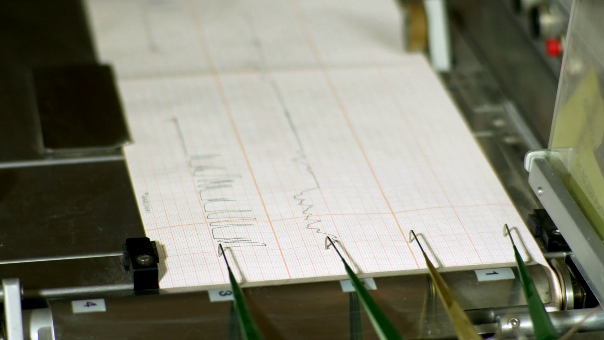 view of a polygraph being taken 4k Stock Video Footage 00:16 SBV ...