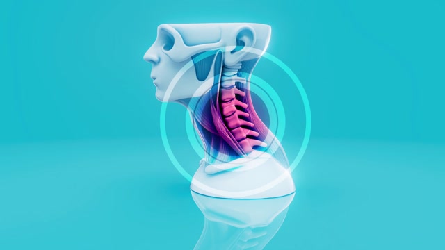 Neck Pain Animation Stock Footage: Royalty-Free Video Clips - Storyblocks