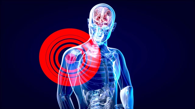 Shoulder Pain Animation Stock Footage: Royalty-Free Video Clips ...