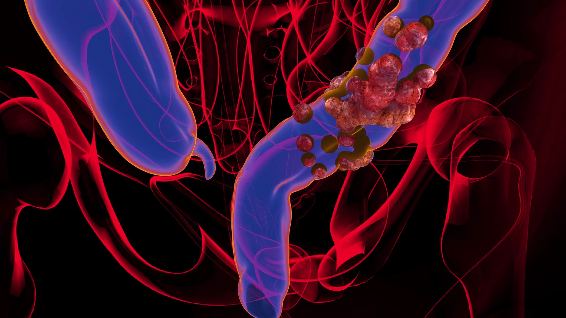 4k Abstract Animation Of Colon Cancer Stock Motion Graphics SBV-348551254 - Storyblocks