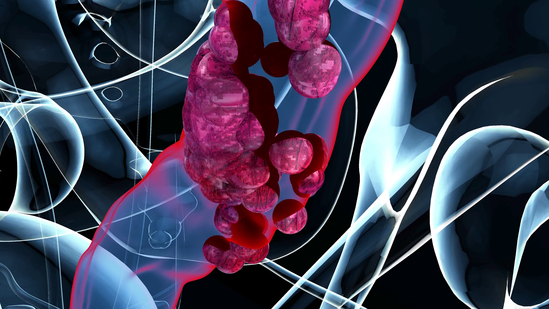 4k Abstract Animation Of Colon Cancer Stock Motion Graphics SBV ...