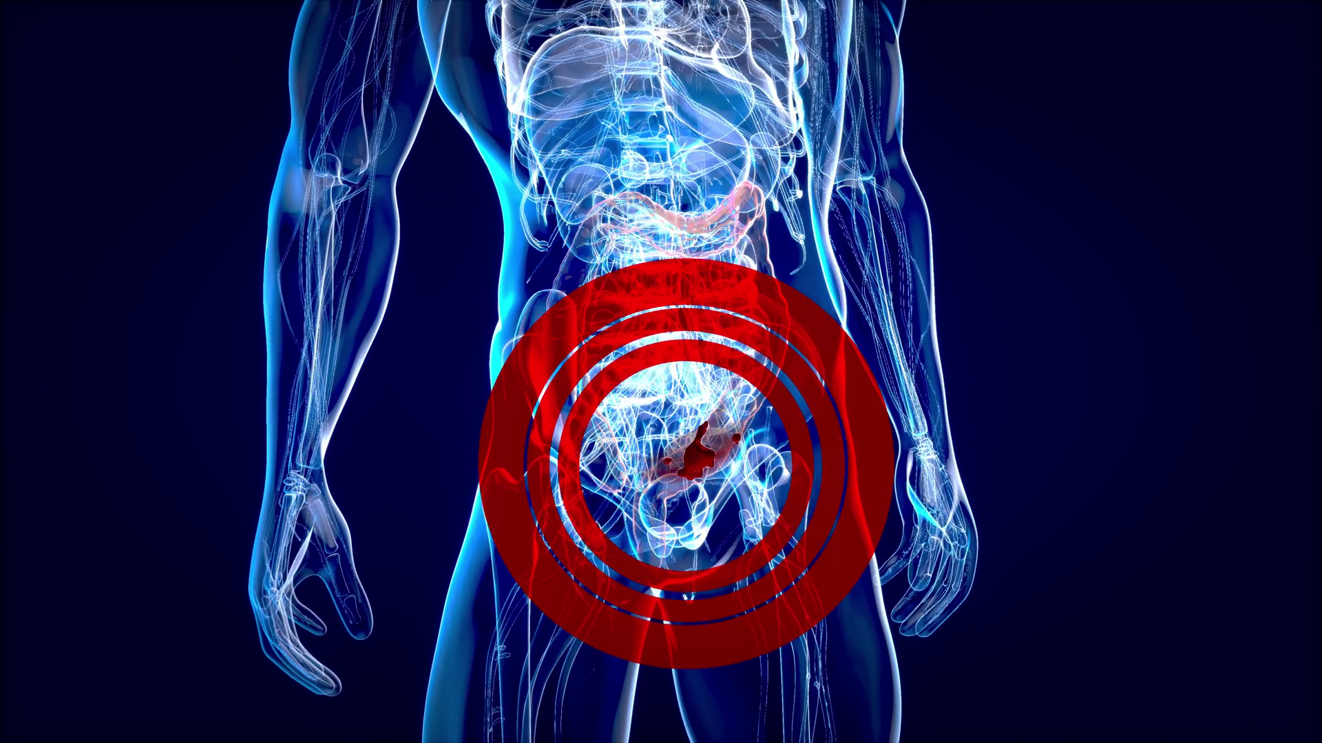 4k Abstract Animation Of Colon Cancer Stock Motion Graphics SBV ...