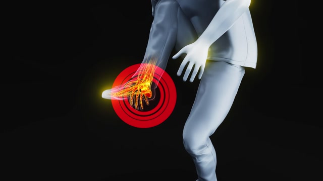 Foot Pain Animation Stock Footage: Royalty-Free Video Clips - Storyblocks