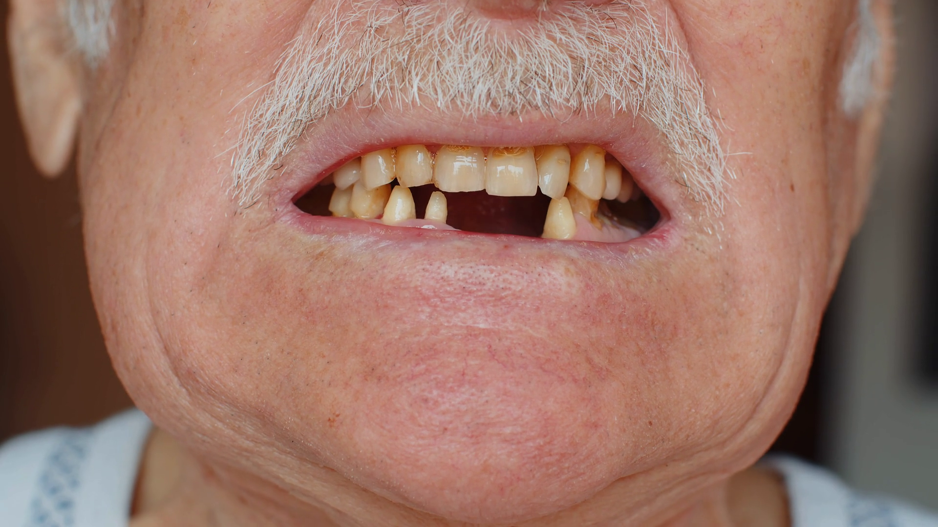 Toothless Male Smile Mouth Of Senior Elderly Stock Footage SBV ...
