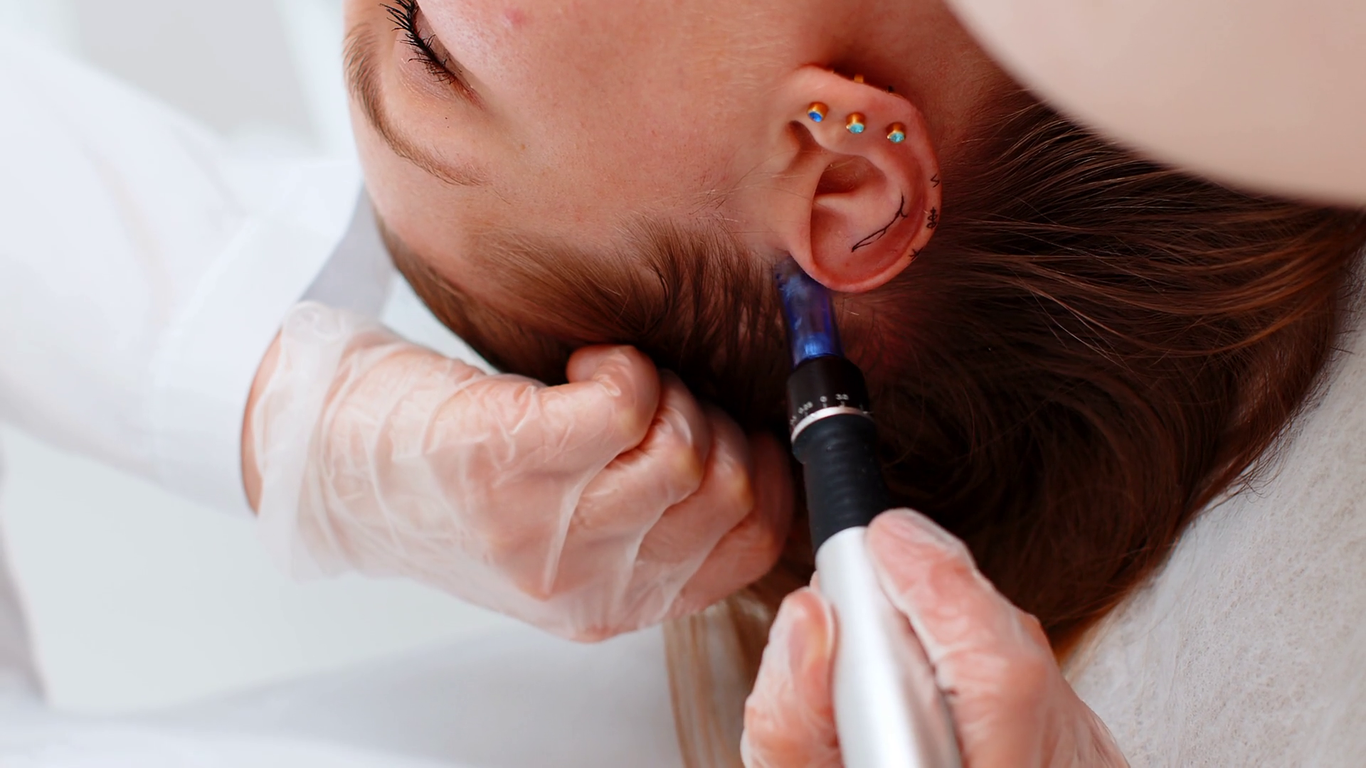 Trichologist Doing Woman Hair Regeneration Stock Footage SBV-352155120 ...