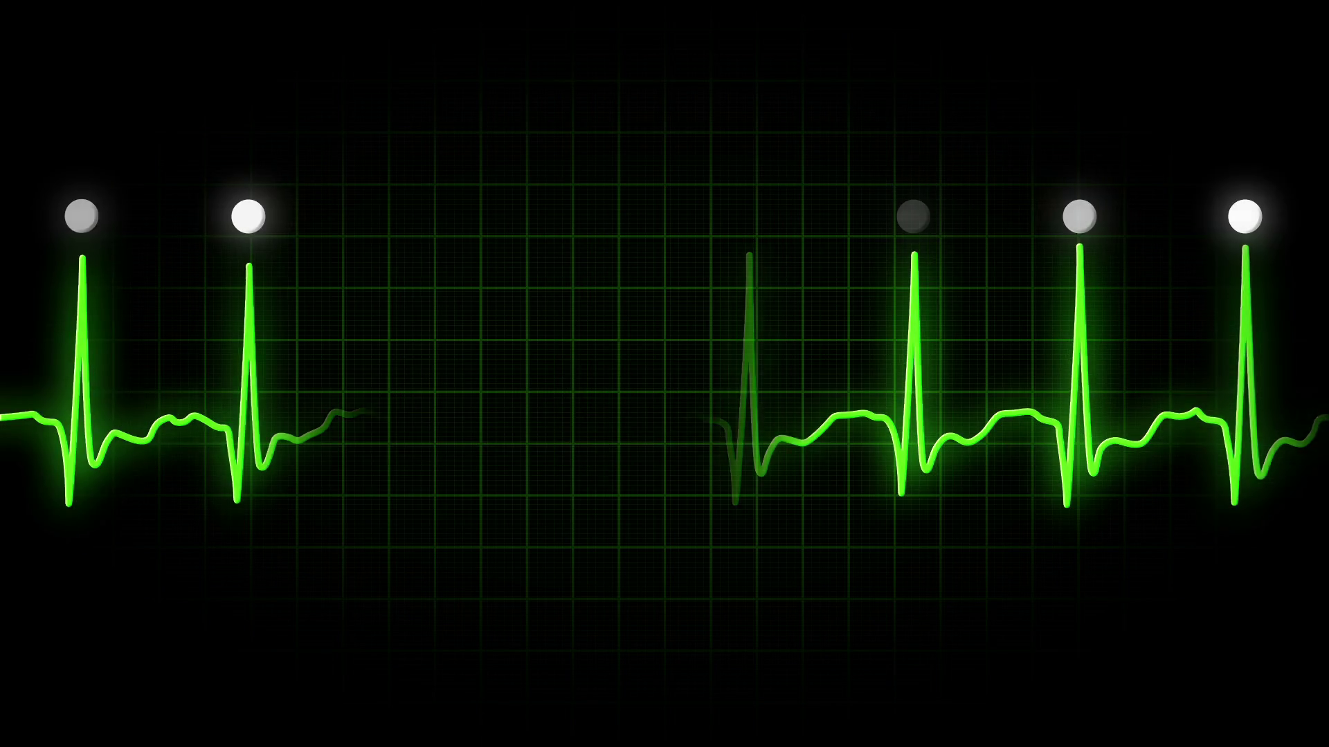 An Animated Heart Monitor Ekg Line Loopable Stock Footage SBV-308521029 ...