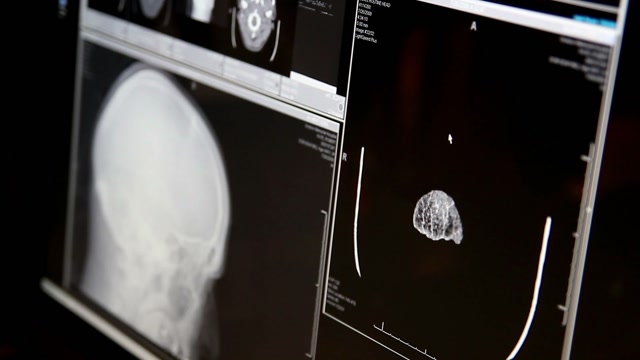 Brain Scanner Stock Footage: Royalty-Free Video Clips - Storyblocks