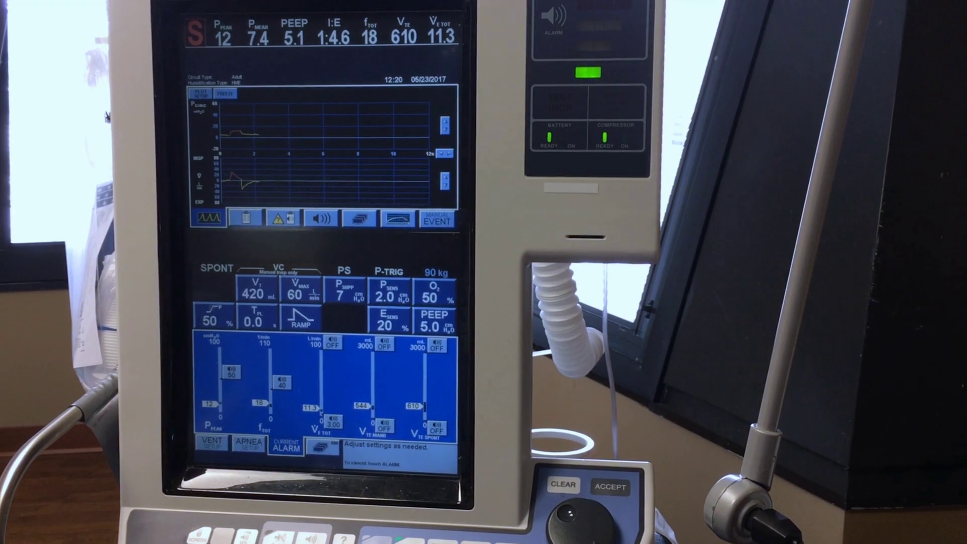 A Ventilator Machine Monitors Hospital Stock Footage SBV-314953171 ...