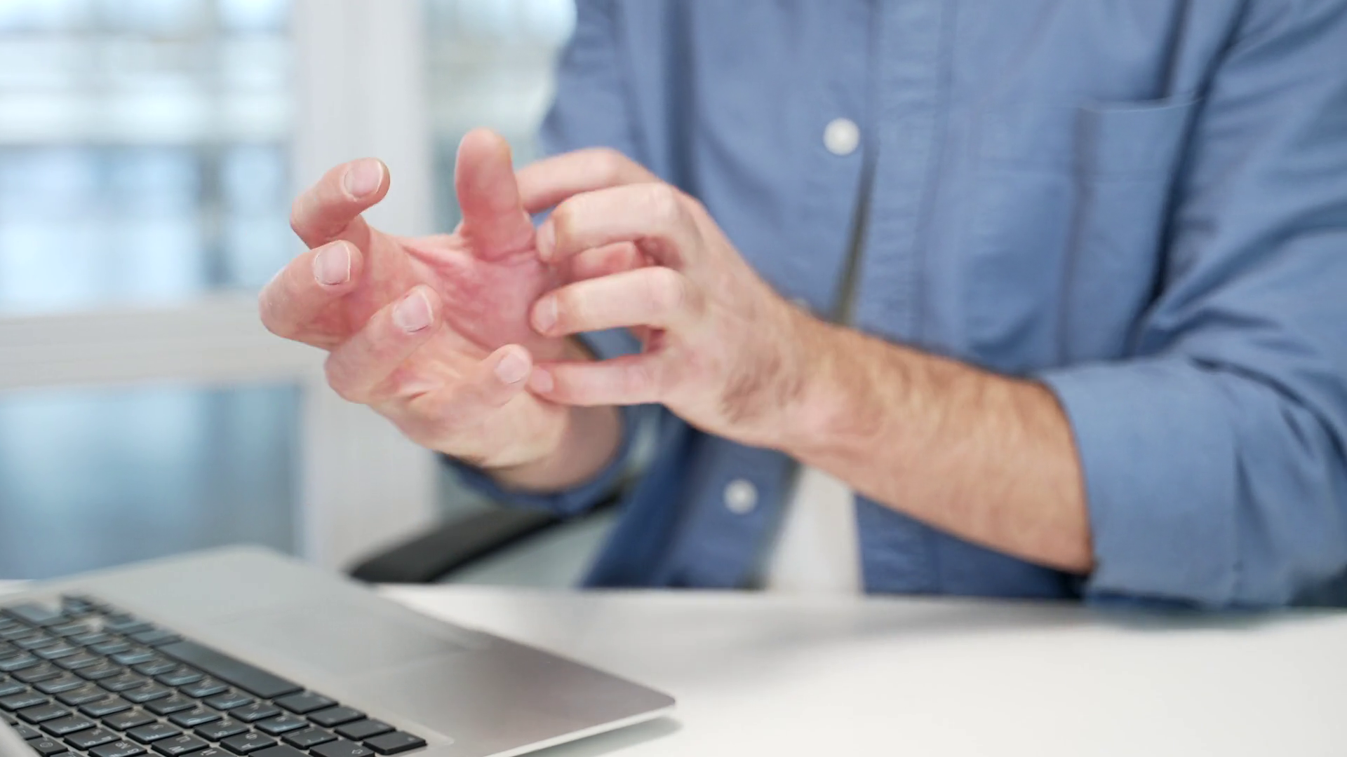 Close Up Of Man Scratching Hand Suffering Stock Footage SBV-351993074 ...