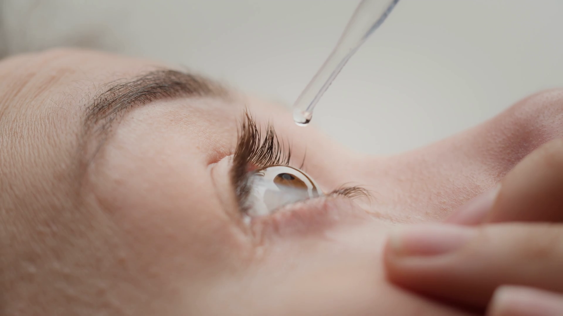 Close-up Shooting Of Dripping Into Eyes From Stock Footage SBV ...