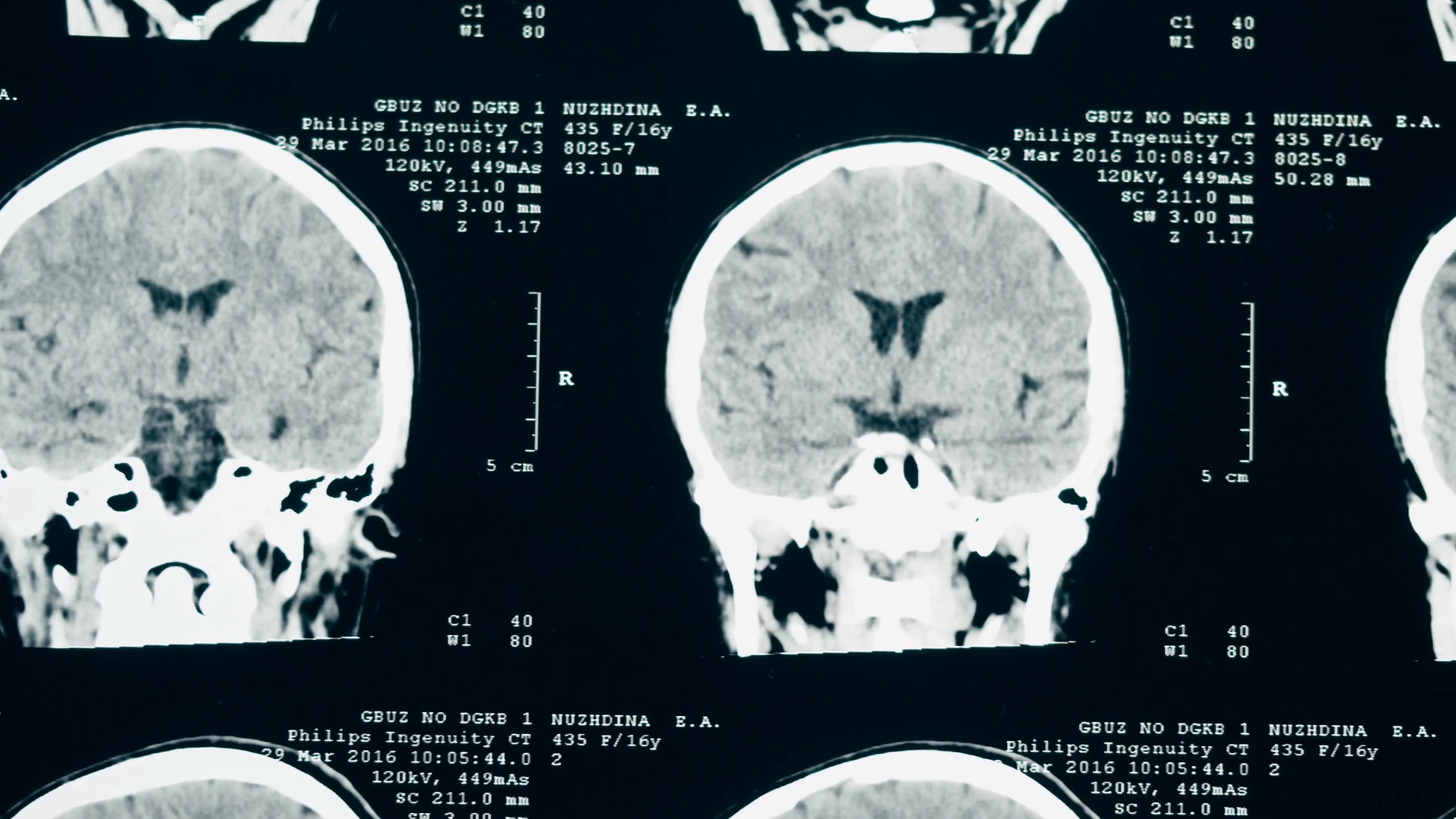 X-ray, Magnetic resonance image of head. Doctor examining human brain ...