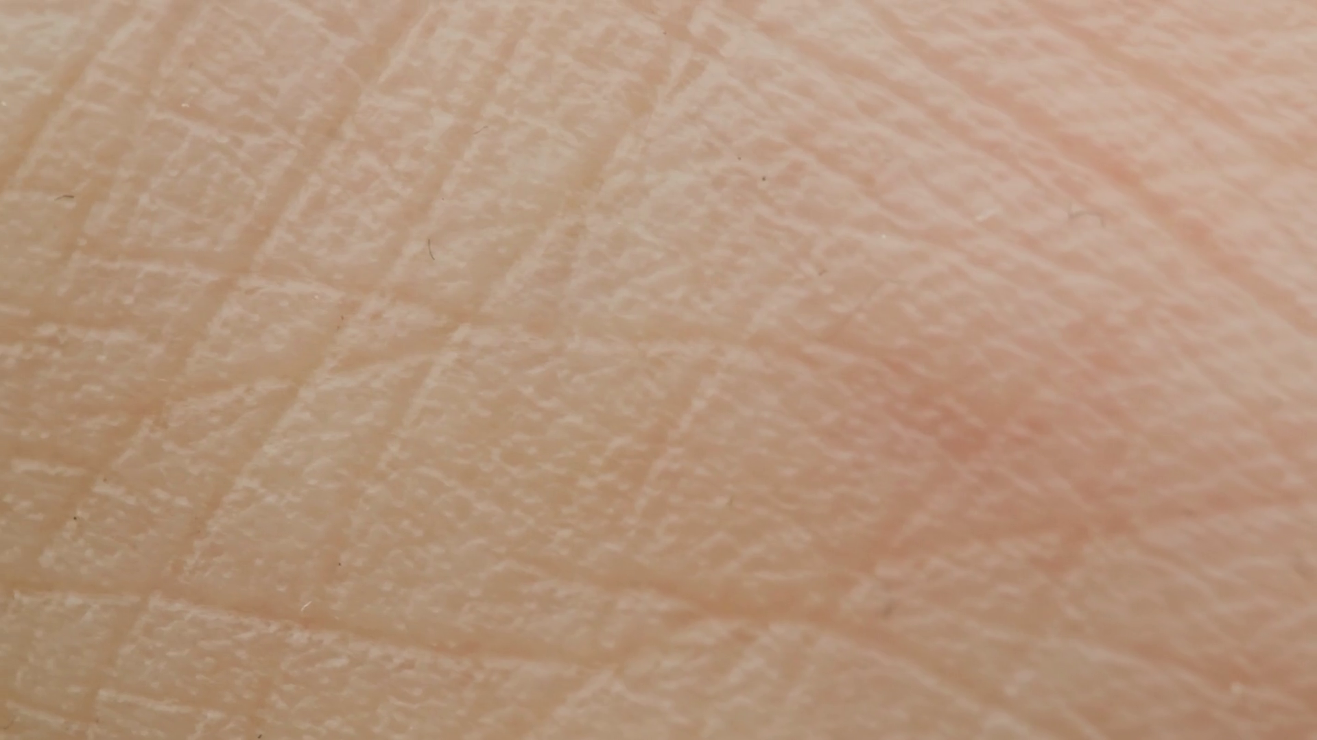 Close-up Of Man Hand Skin Texture Macro Stock Footage SBV-347798307 ...