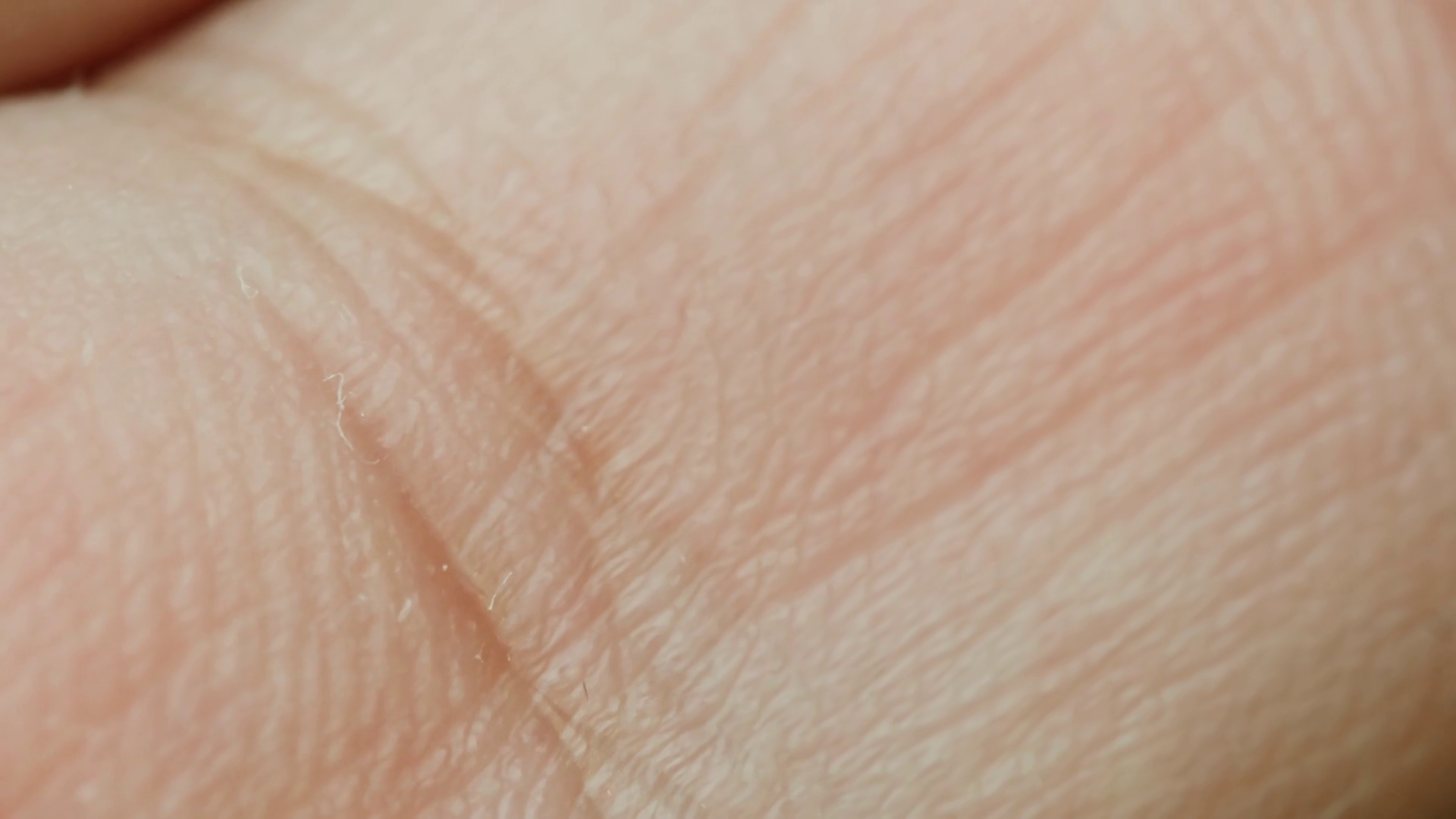 Close-up Of Man Hand Skin Texture Macro Stock Footage SBV-347798302 ...