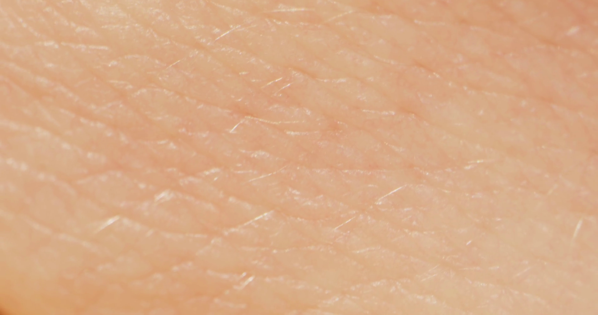 Hand Skin Texture Close-up Arm Surface Macro Stock Footage SBV ...