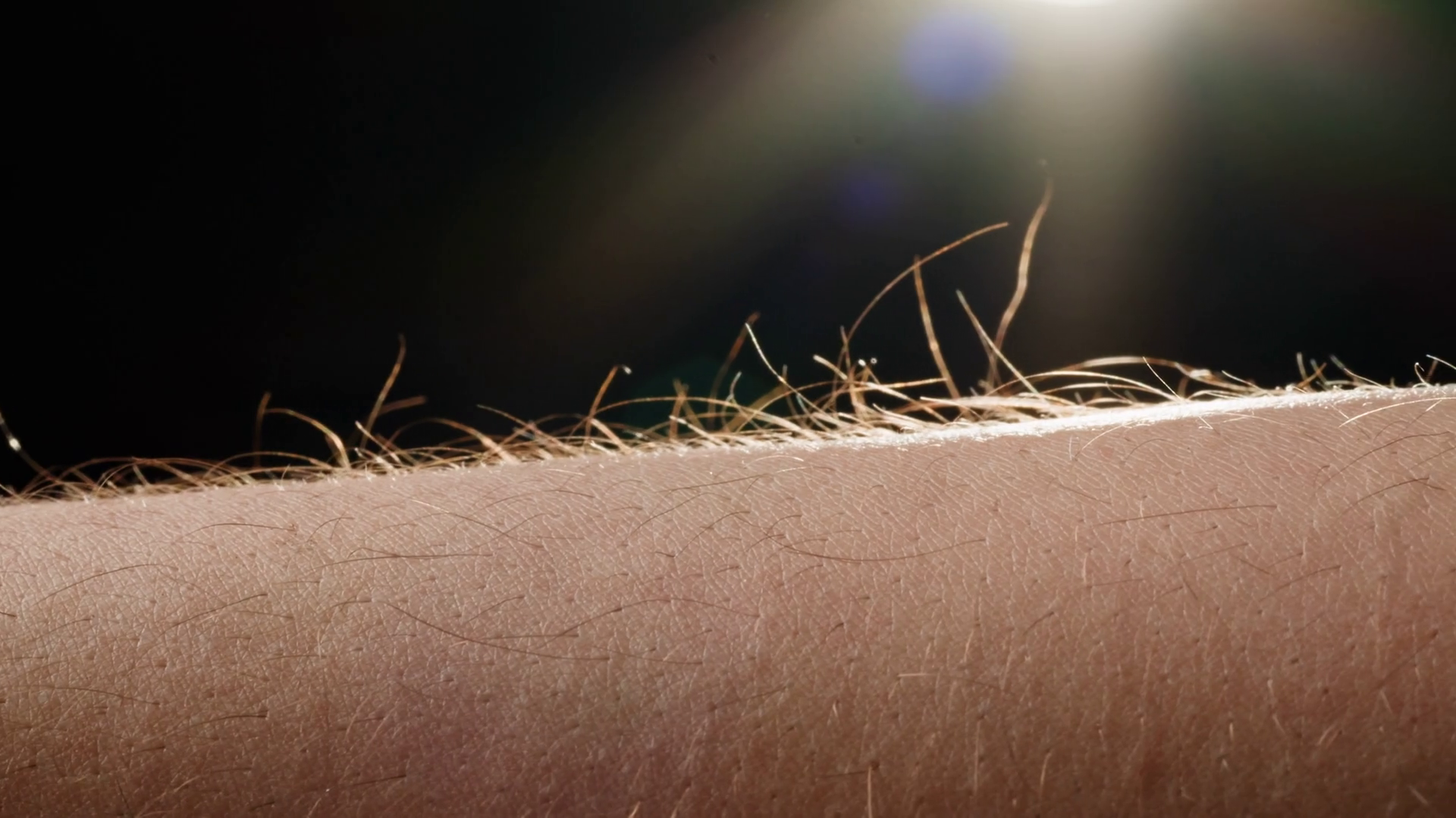 Hand Skin Texture Hair Goosebumps Close-up Stock Footage SBV-347659059 ...