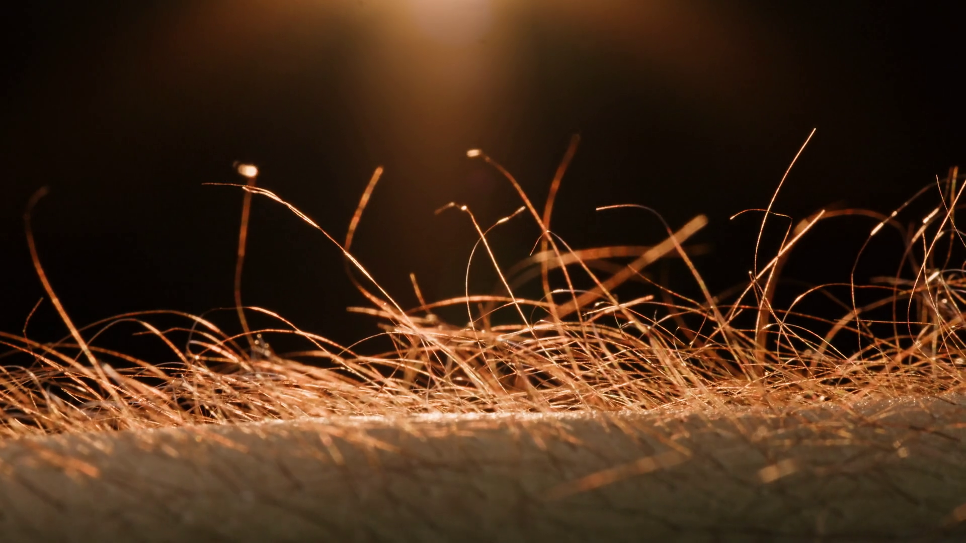 Hand Skin Texture Hair Goosebumps Close-up Stock Footage SBV-347729042 ...
