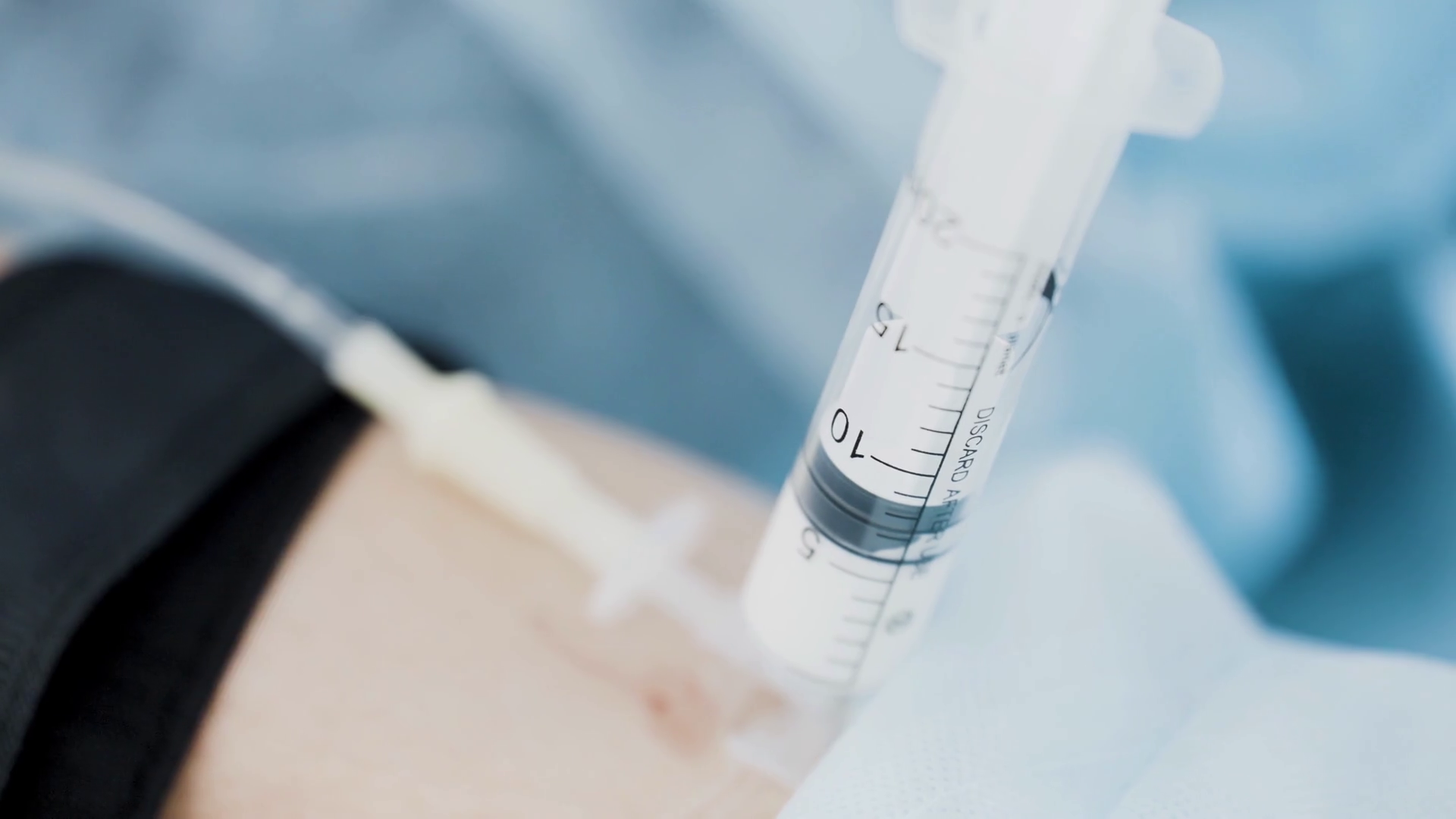 Close-up Shot Of Anesthesia Action Injection Stock Footage SBV ...