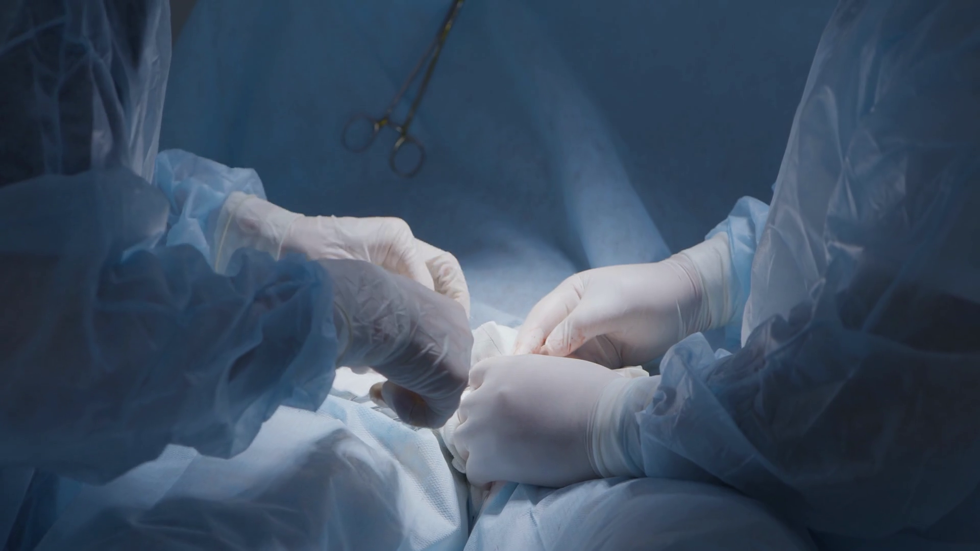 Suturing During Surgery Action Hands Of Stock Footage SBV-348445490 ...