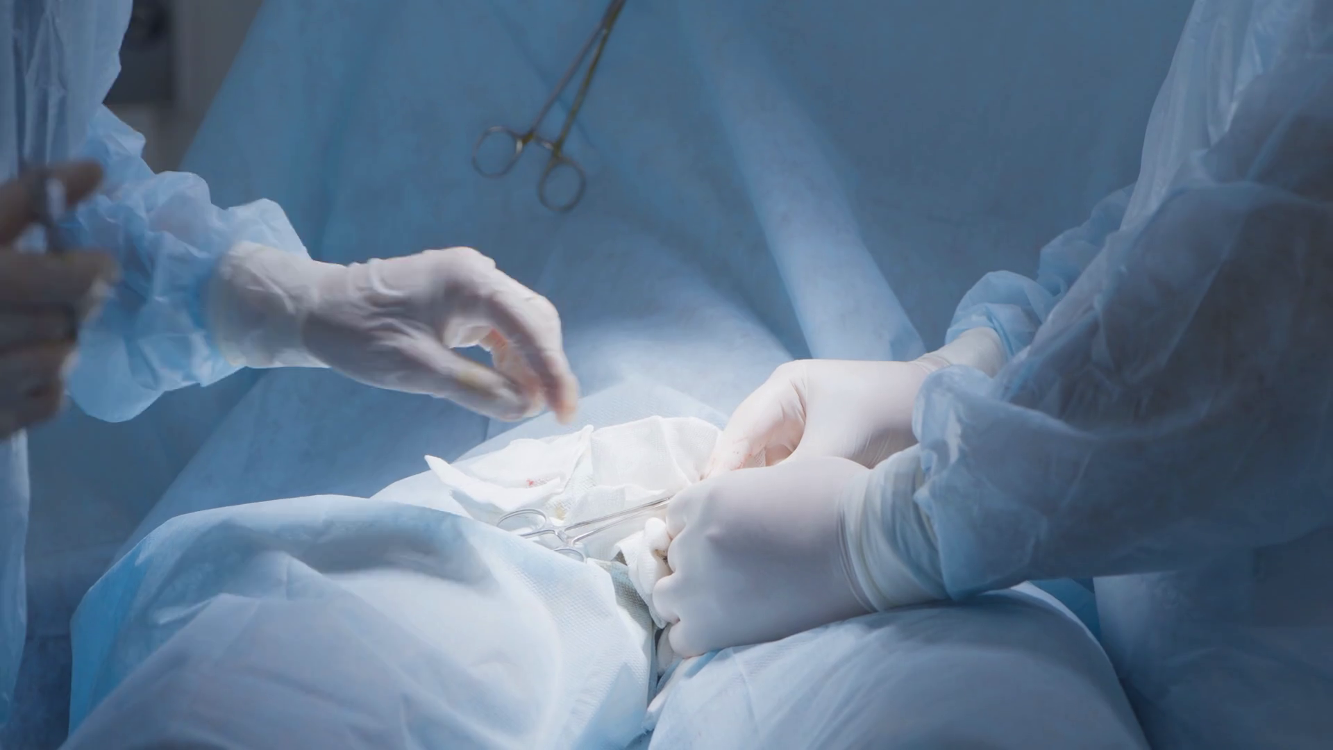 Surgeons Apply Stitches Action Applying Stock Footage SBV-348442066 ...