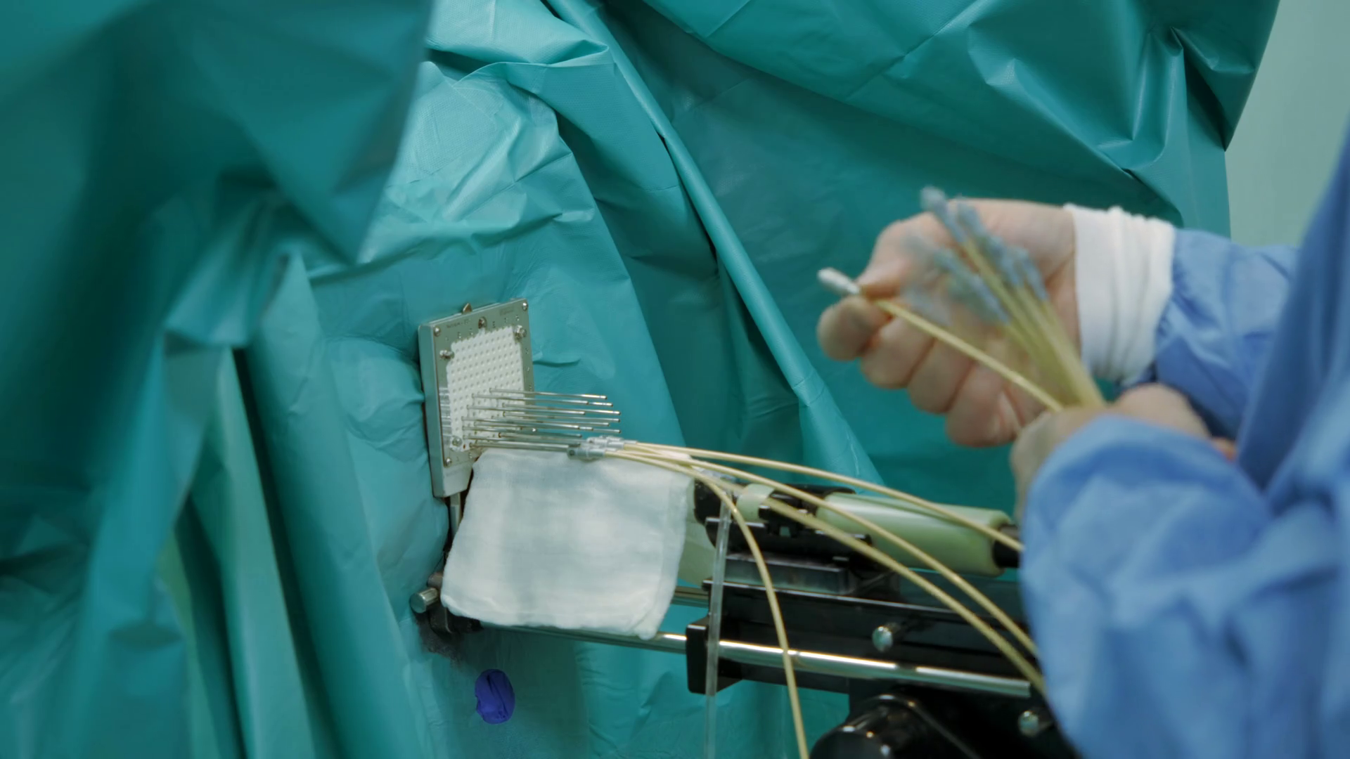 Close Up Of Medical Procedure At Hospital Stock Footage SBV-348600565 ...