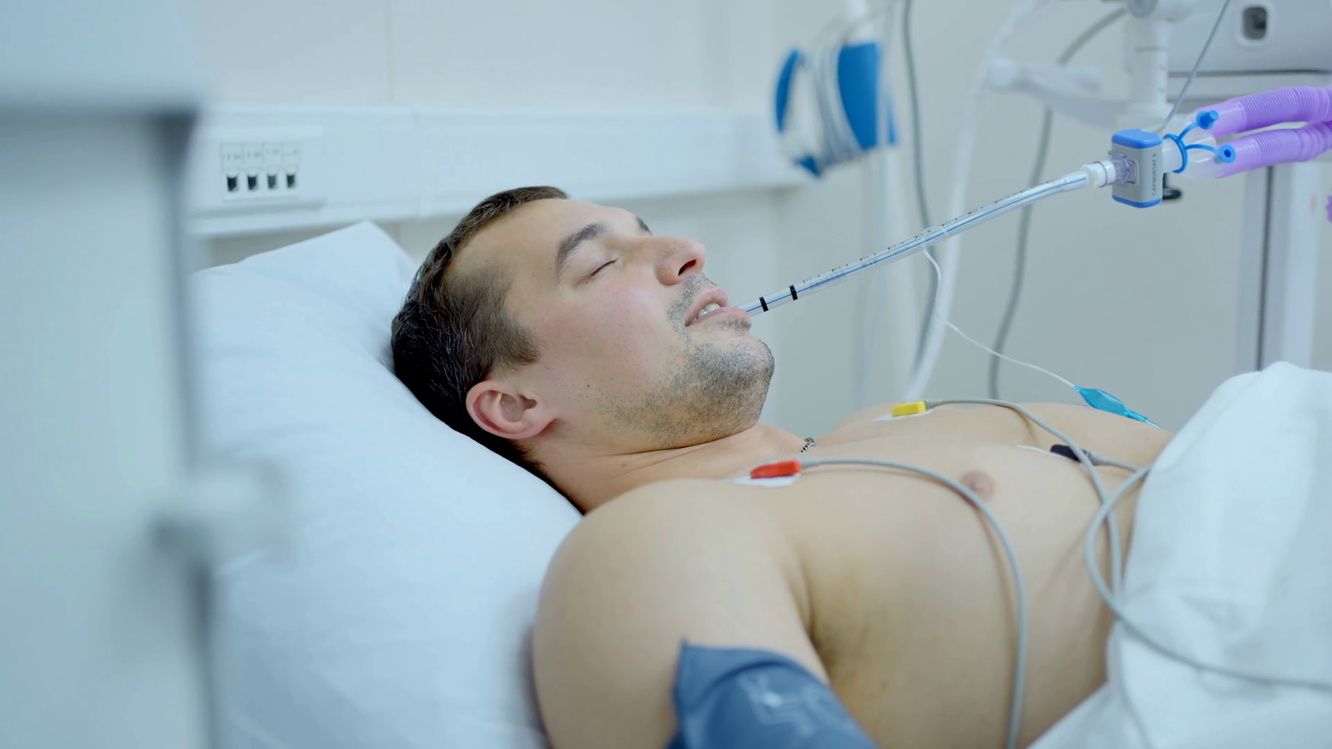 Man Opened Eyes Anesthesia Action Man In Stock Footage SBV-348618199 ...