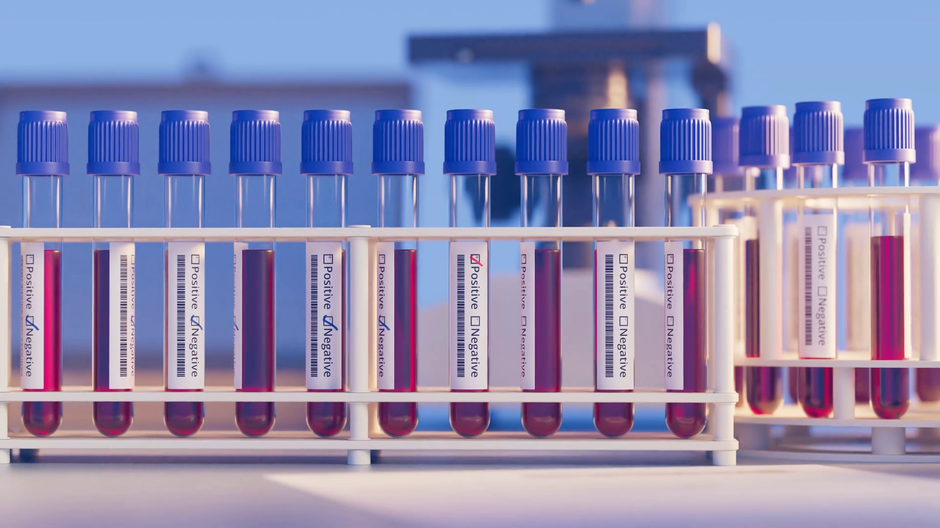 Positive Negative Blood Samples Test Tubes Stock Motion Graphics SBV ...