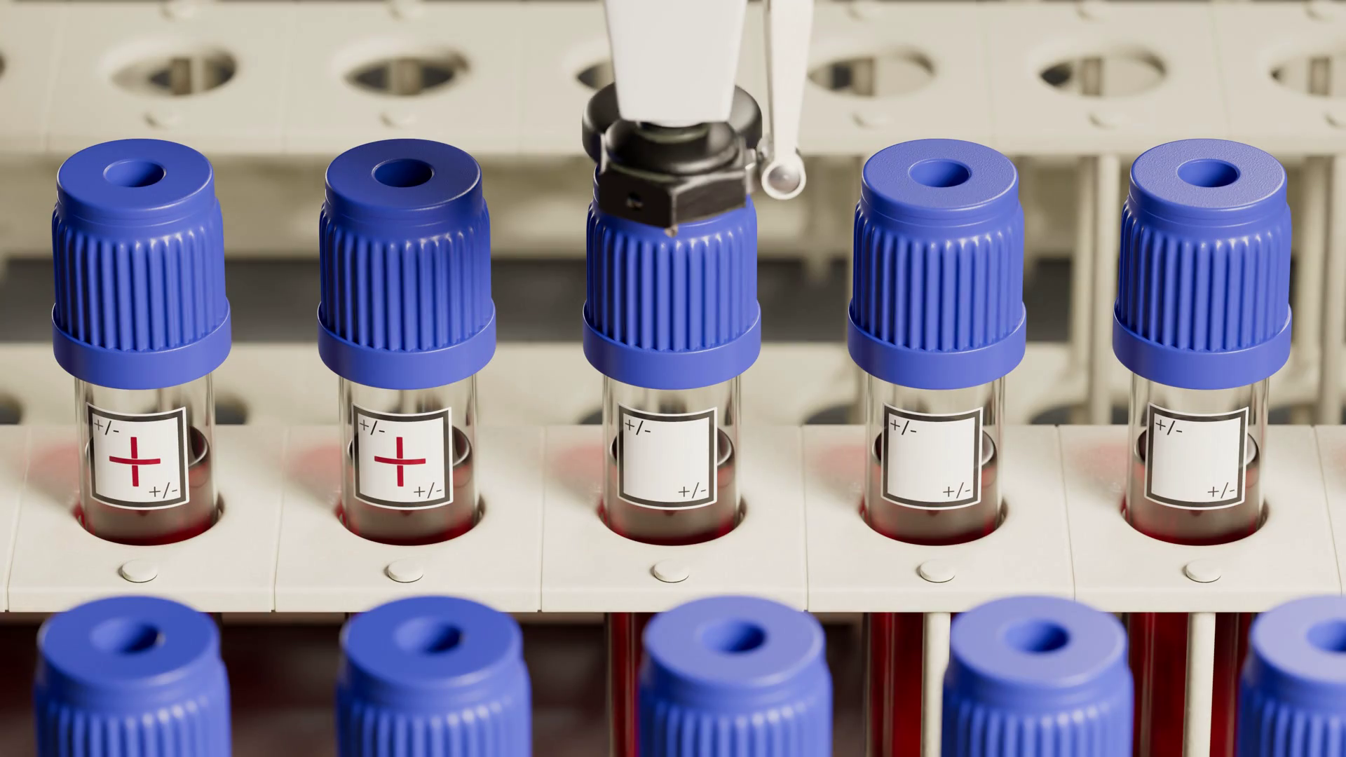 Modern Lab Robot Tests Blood Samples Stock Motion Graphics SBV ...