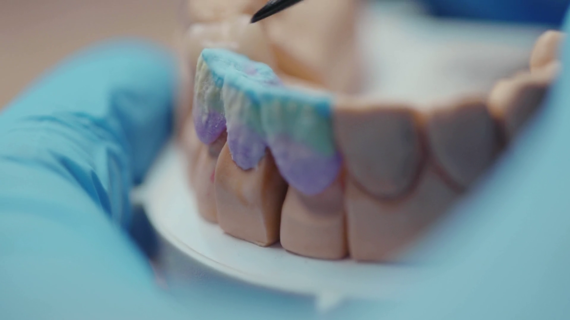 Close Up Hands Dentist Makes Denture Tooth Stock Footage SBV-352213399 ...