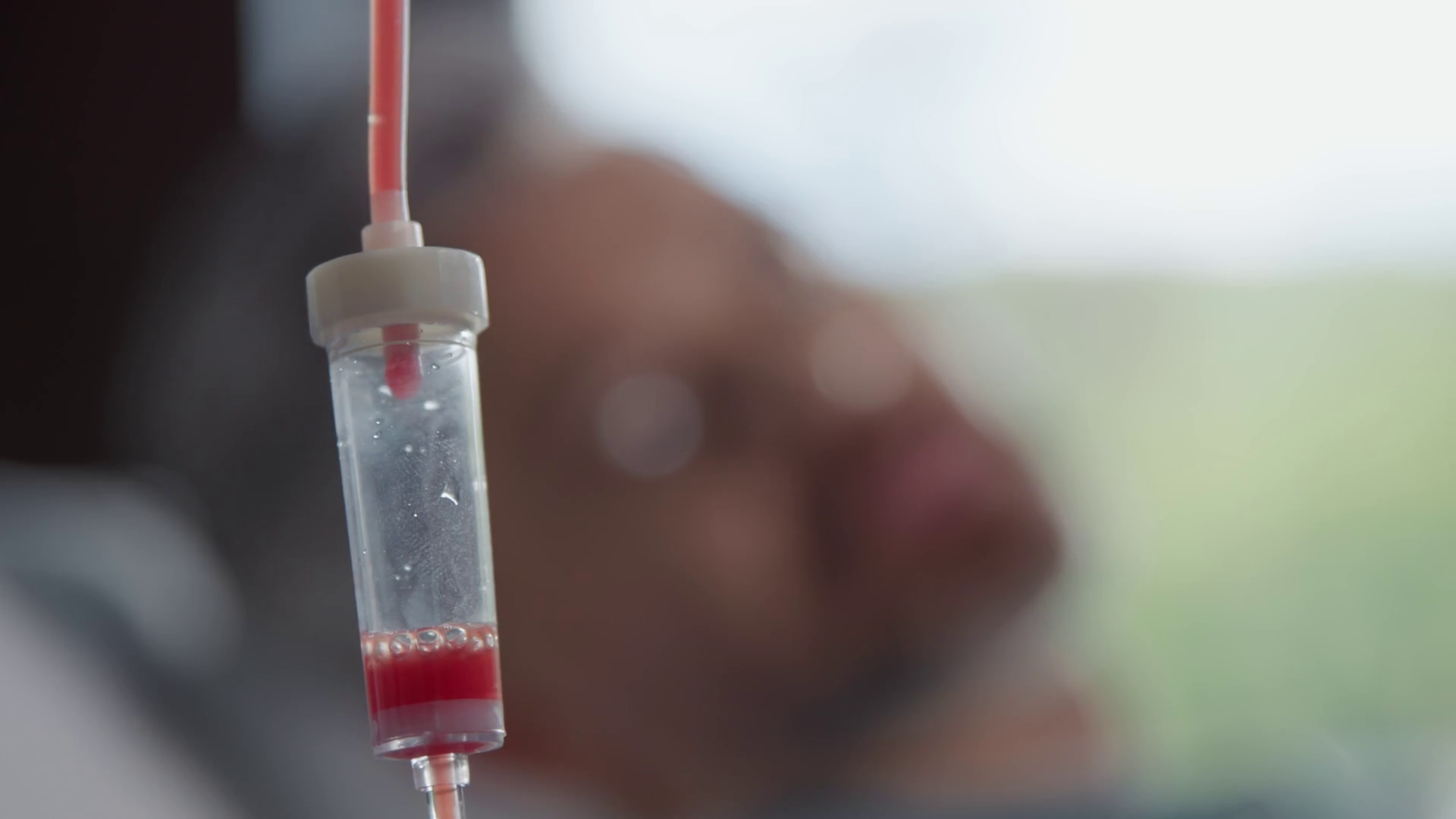 Close Up Shot Of Blood Transfusion On Stock Footage SBV-352130798 ...