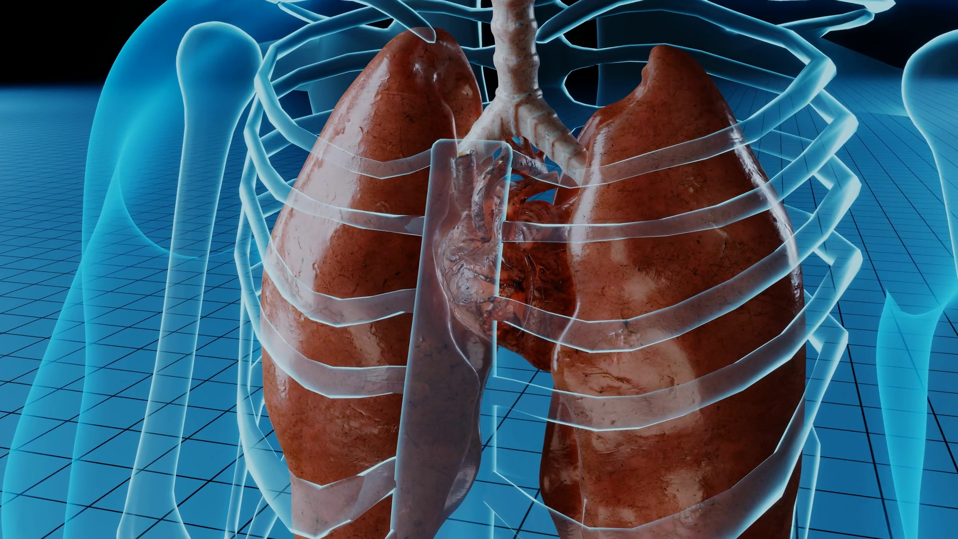 Heart Damage Medical Representation With Red Stock Motion Graphics SBV ...