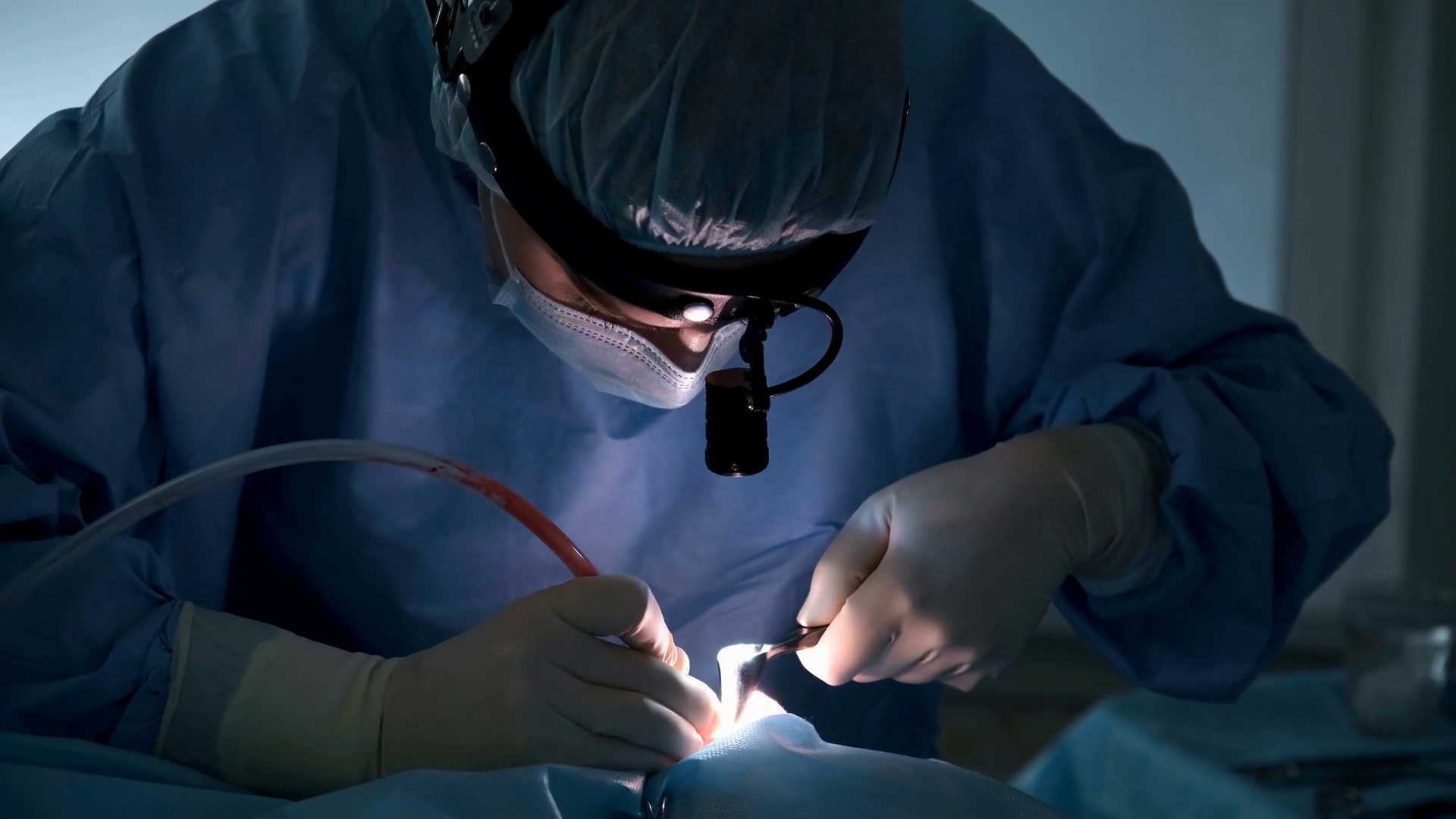 Skilled Surgeon Meticulously Operates On Stock Footage SBV-352006165 ...