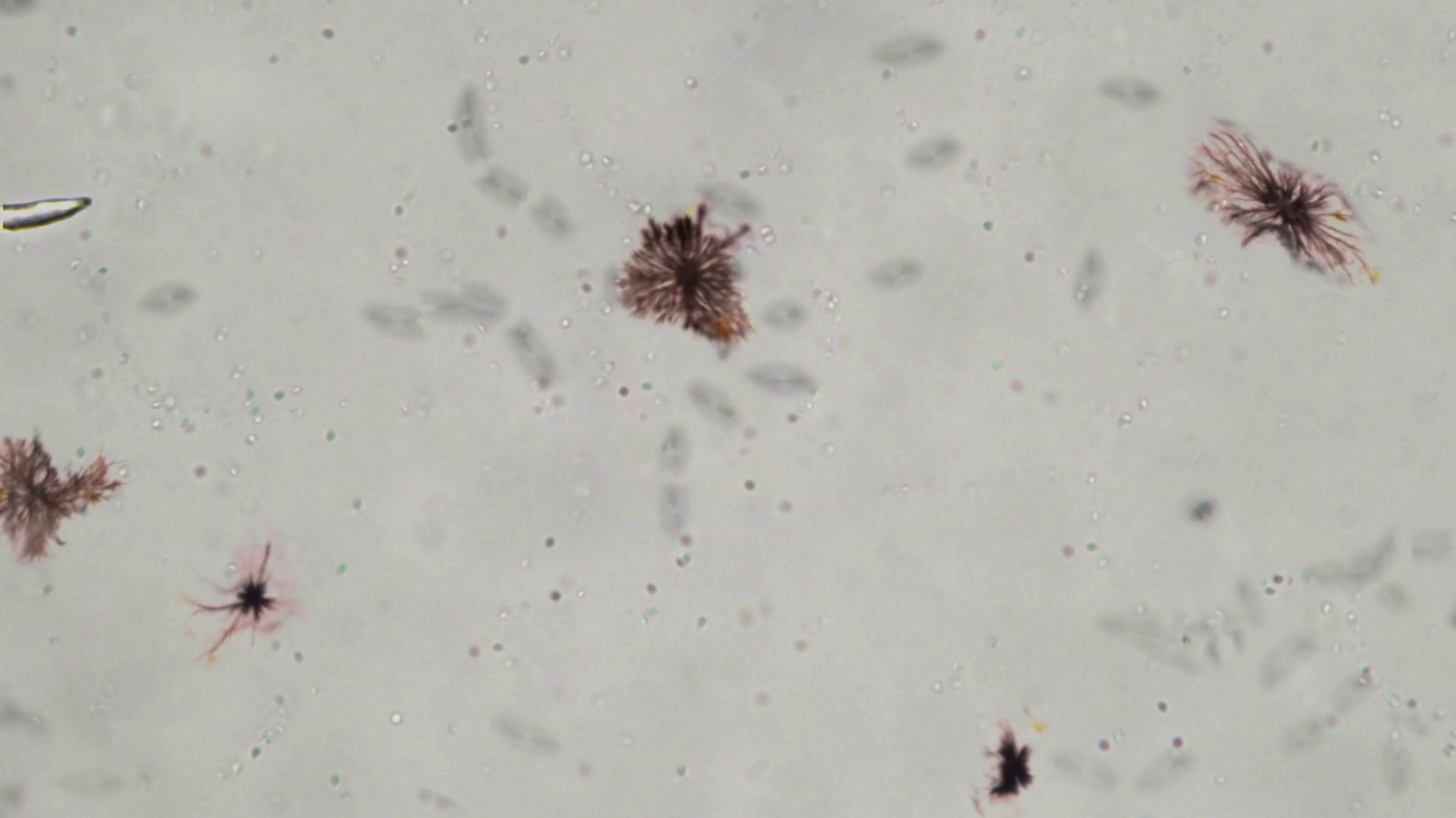 A Microscopic Animation Imitating View Stock Motion Graphics SBV ...