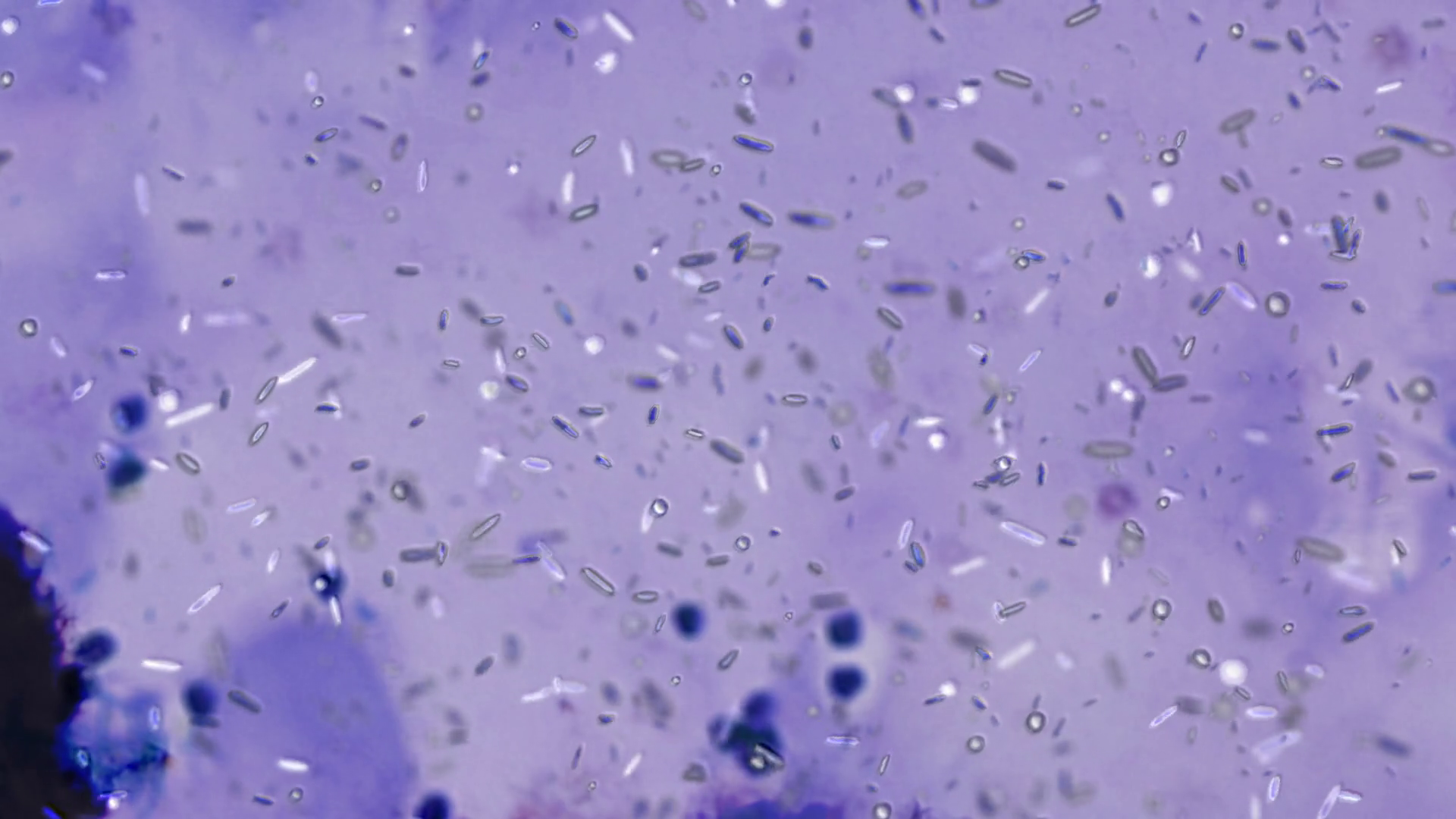 A Realistic Animation Imitating View Through Stock Motion Graphics SBV ...