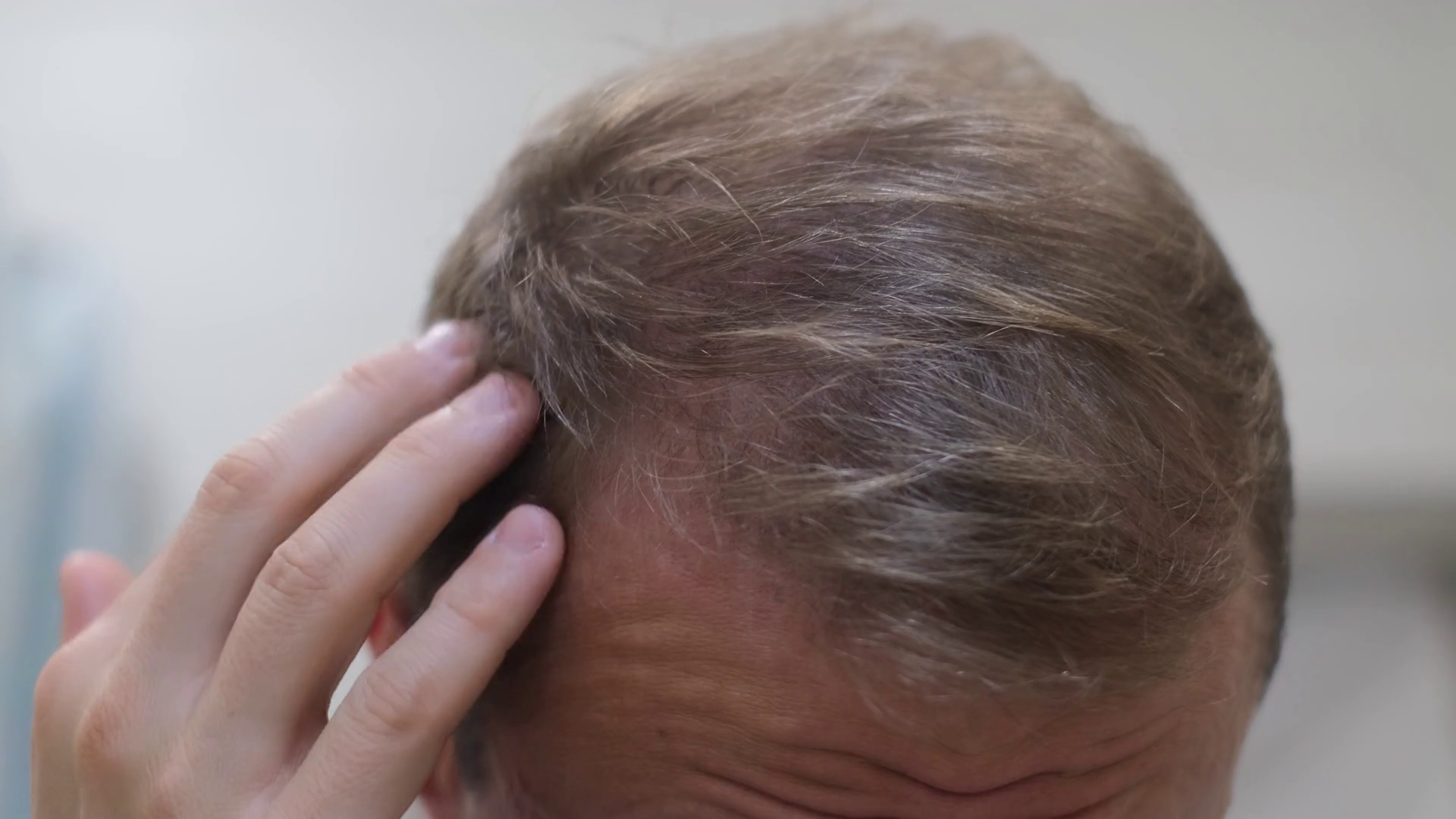 Close-up Of Adult Man With Thin Sparse Stock Footage SBV-352038631 ...